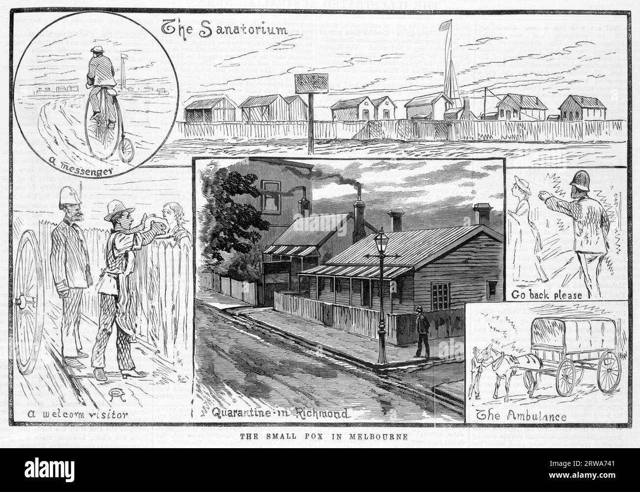 Smallpox 19th century hi-res stock photography and images - Alamy