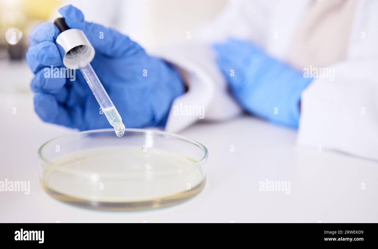 Petri dish, hand and pipette for medical science research, medicine ...