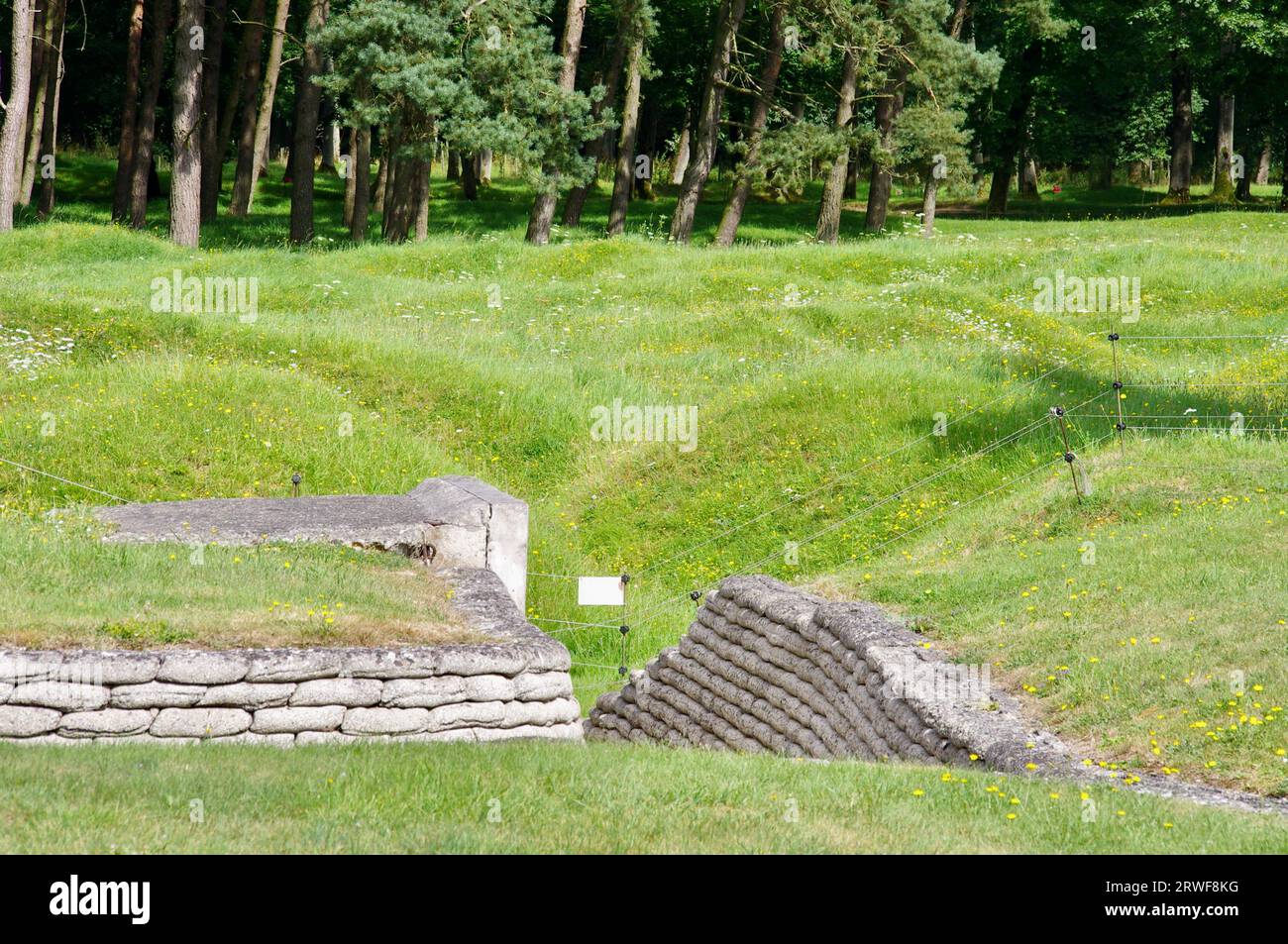 Remains of WW1 Trenches at Vimy Ridge Battlefield. Vimy, France Stock ...