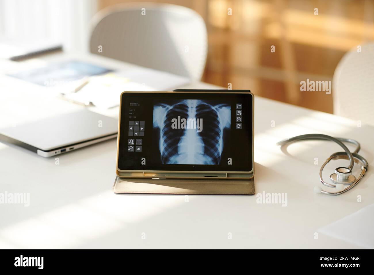 Tablet computer with lungs x-ray image on screen of tablet computer ...