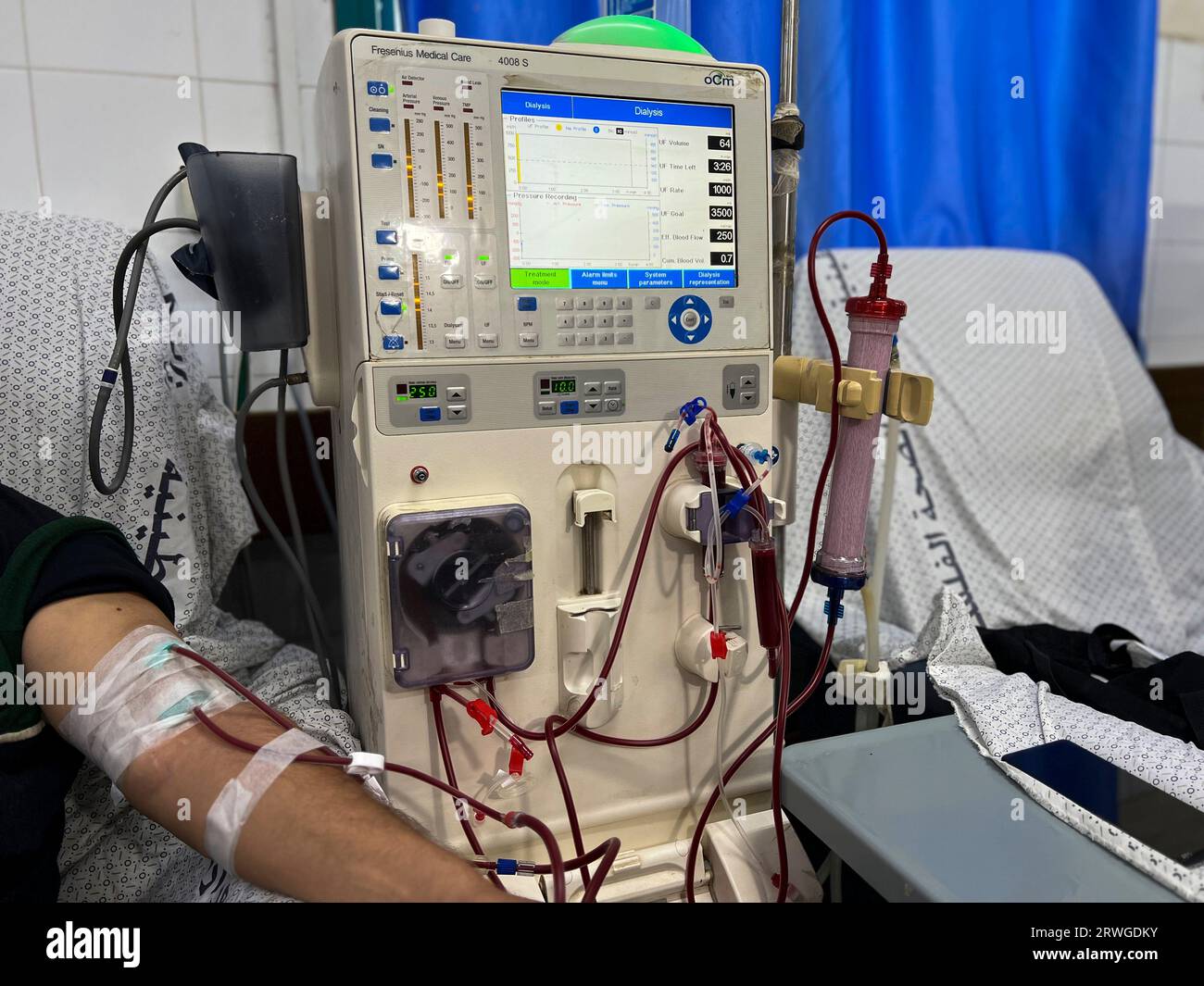Types anemia hi-res stock photography and images - Alamy