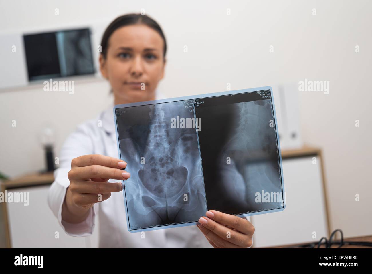 Vertical video physician showing radiography hi-res stock photography ...