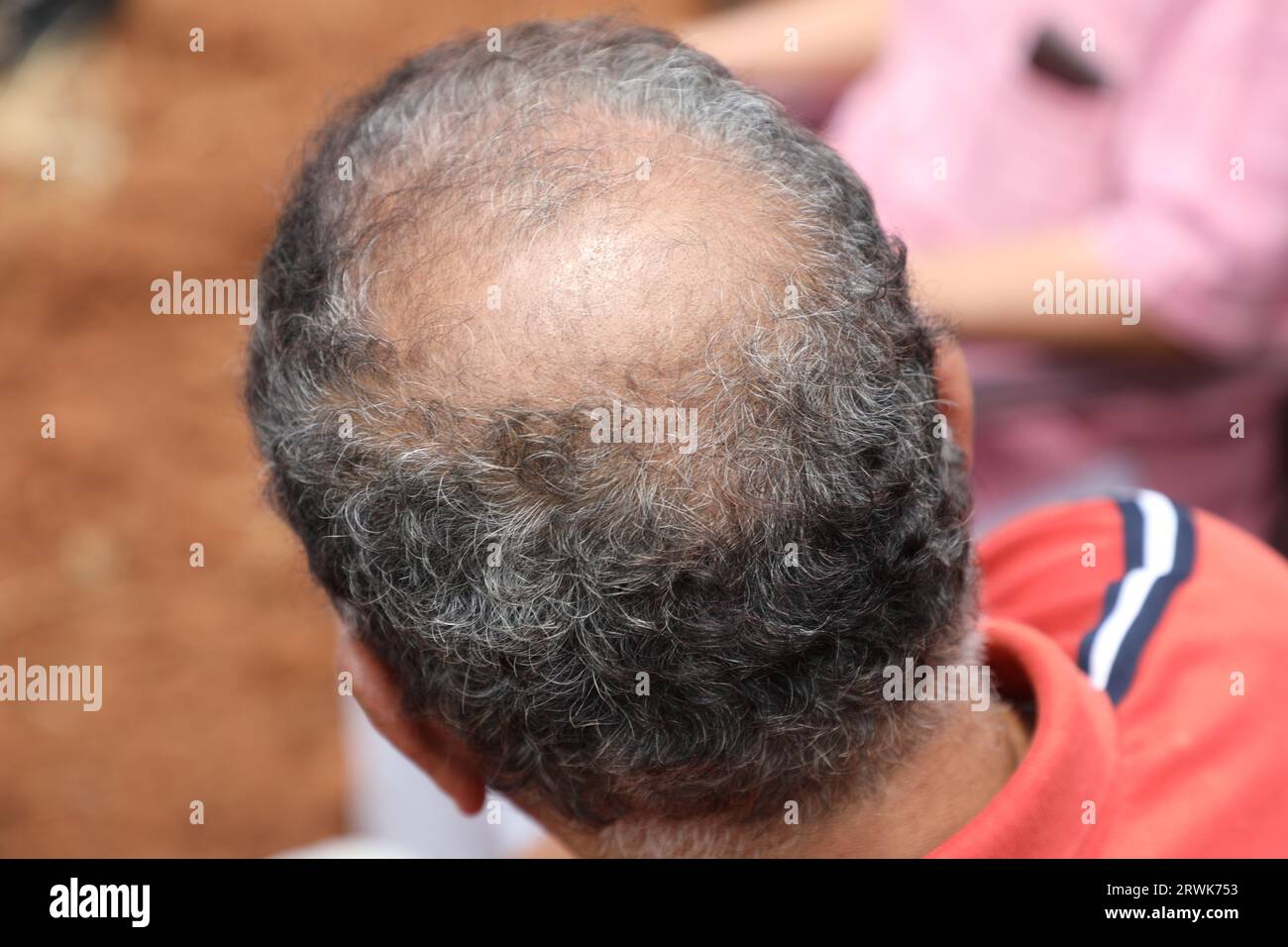 Rear view of Bald head man Stock Photo - Alamy
