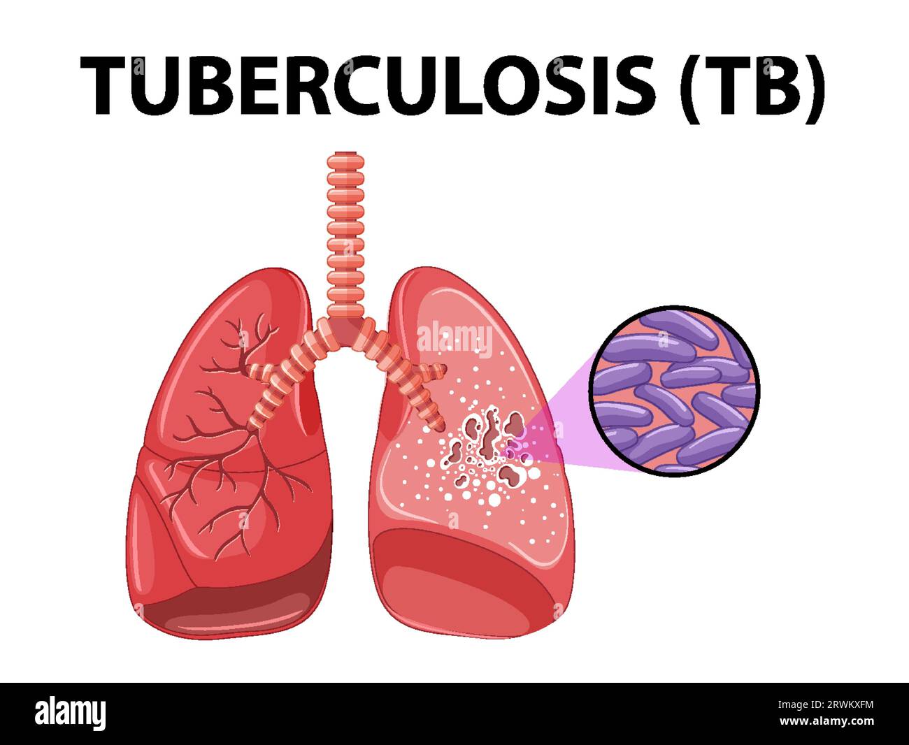 Illustrated infographic showcasing the medical education of human lung ...