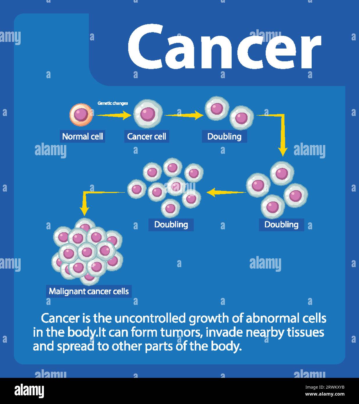 Understanding the development and processing of cancer cells through an ...