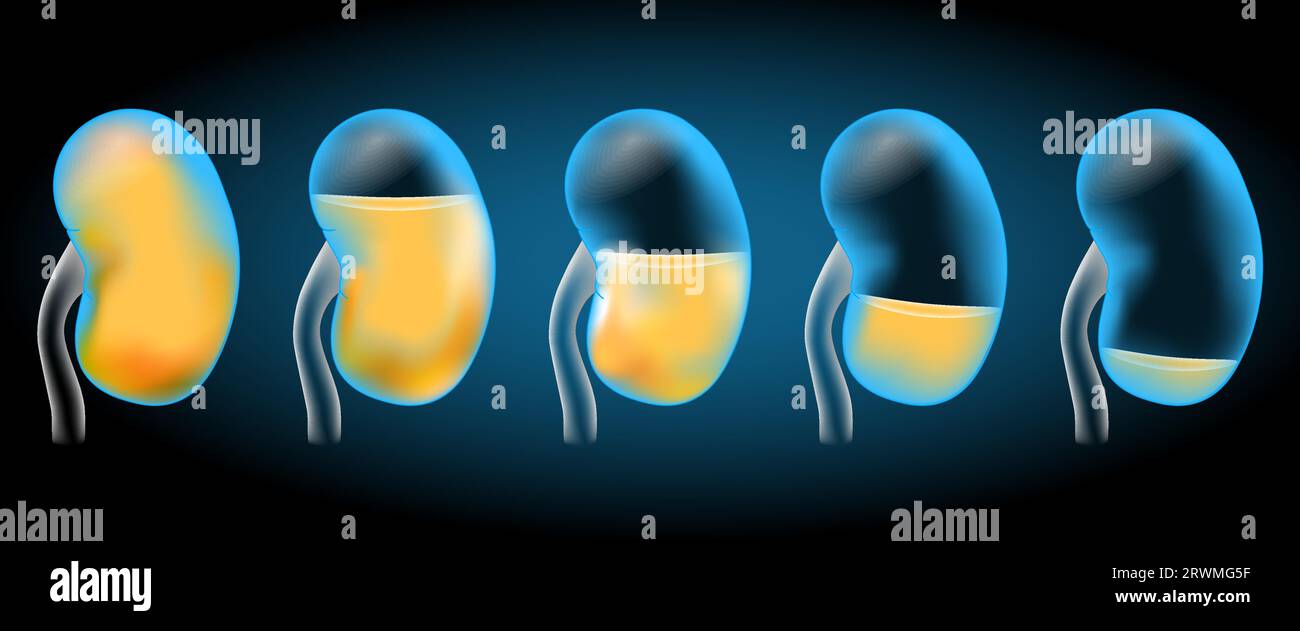 Kidneys and urine with glowing effect. Realistic transparent blue ...