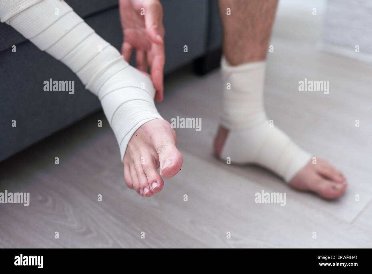 Stress fracture tibia hi-res stock photography and images - Alamy