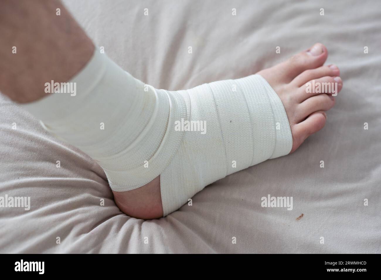 Stress fracture tibia hi-res stock photography and images - Alamy