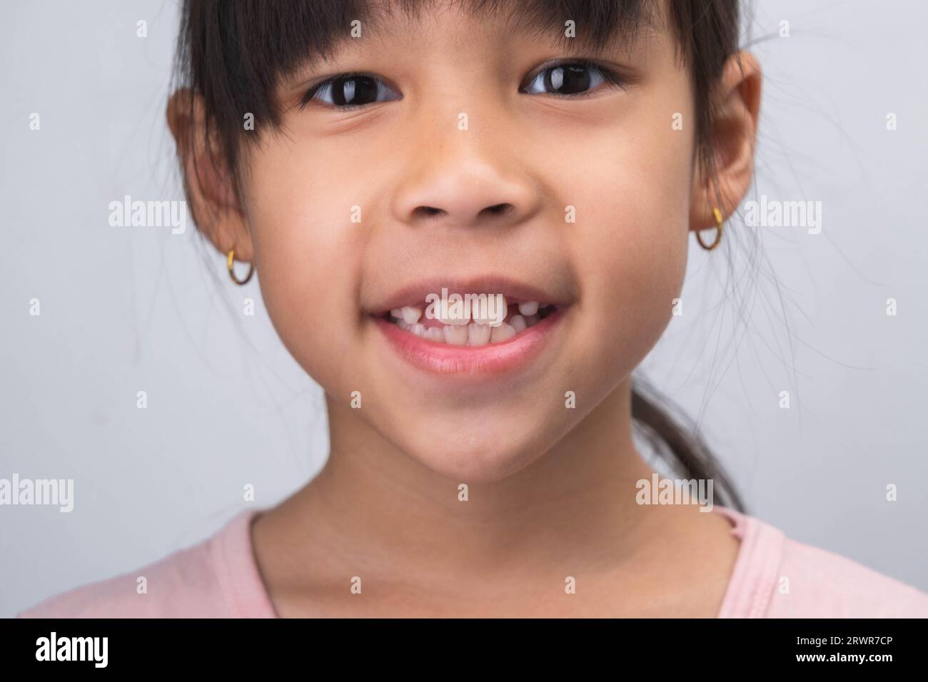 Close-up of cute young girl smiling wide, showing empty space with ...