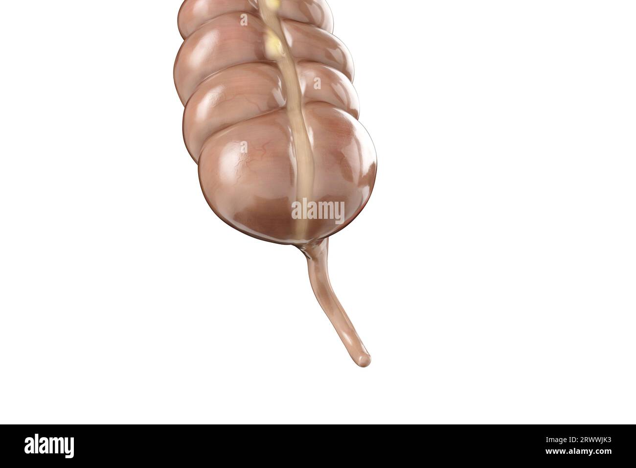 3d illustration of human appendix anatomy. High quality realistic ... 3d illustration of human appendix anatomy. High quality realistic ...