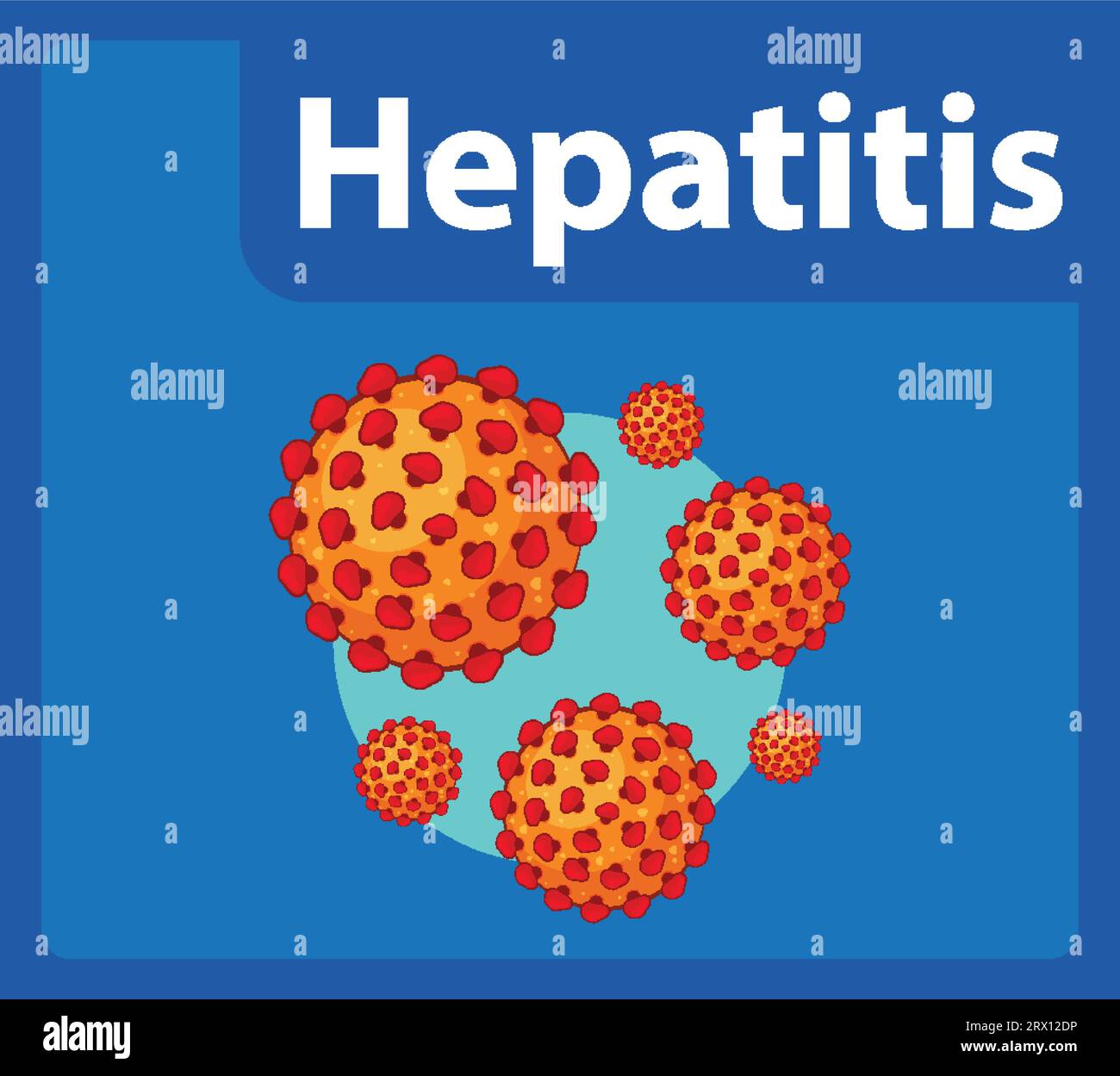 Detailed cartoon-style illustration of a hepatitis virus cell Stock ...
