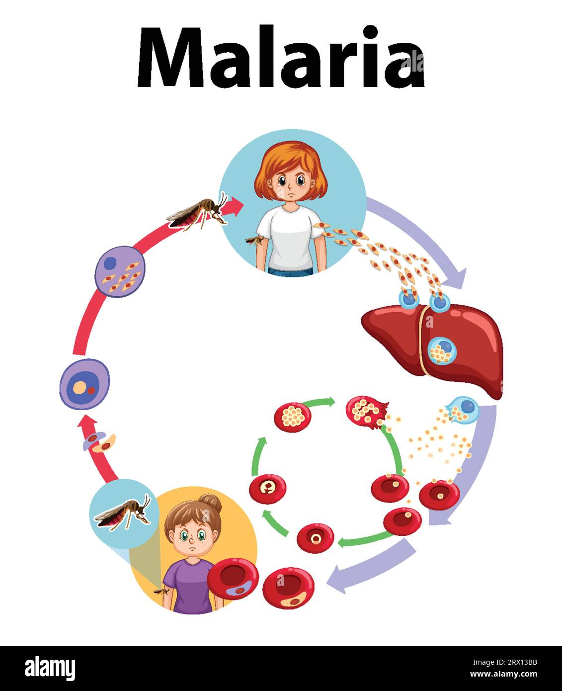 Illustrated infographic depicting the stages of malaria parasite ...