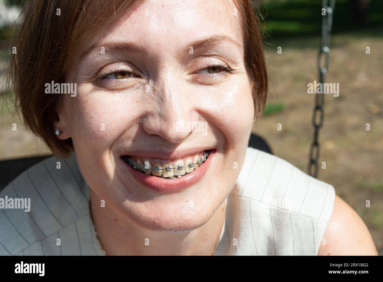 Braces mouth woman hi-res stock photography and images - Alamy