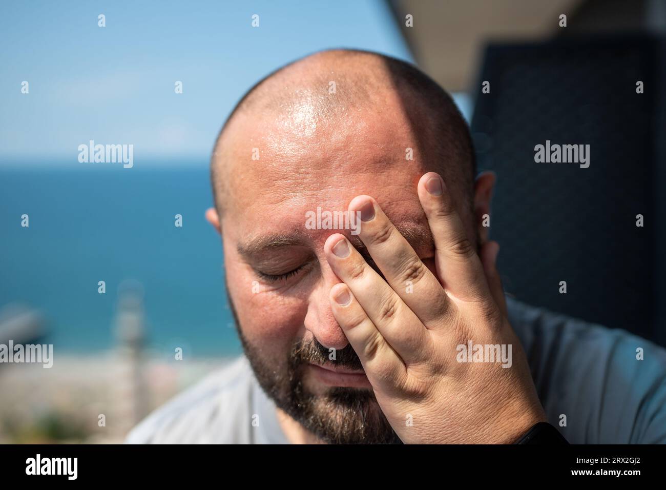 Portrait of overweight man suffering hyperhidrosis, high sweating in ...