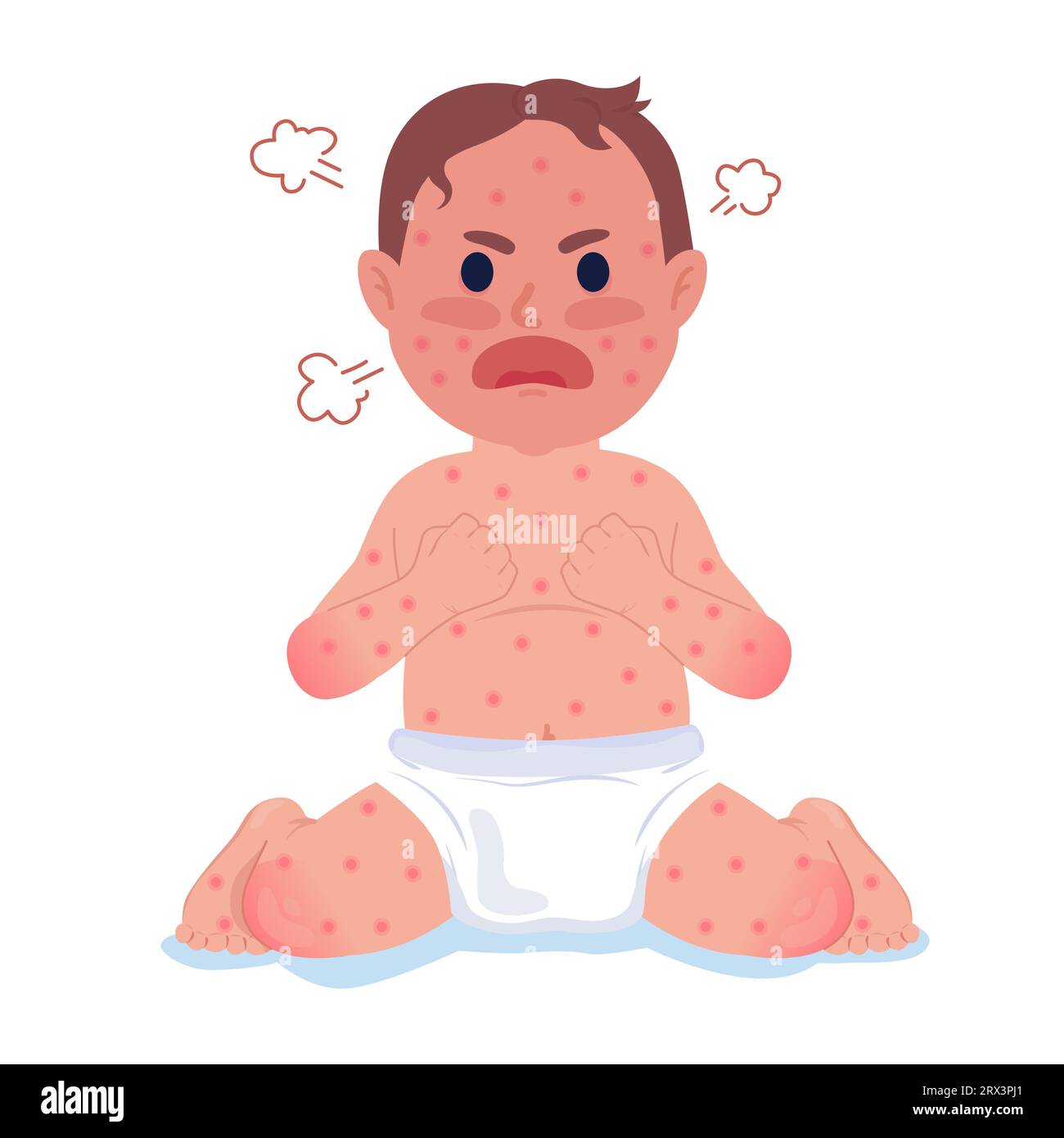 Crying baby with measles 2D cartoon character Stock Vector Image & Art ...