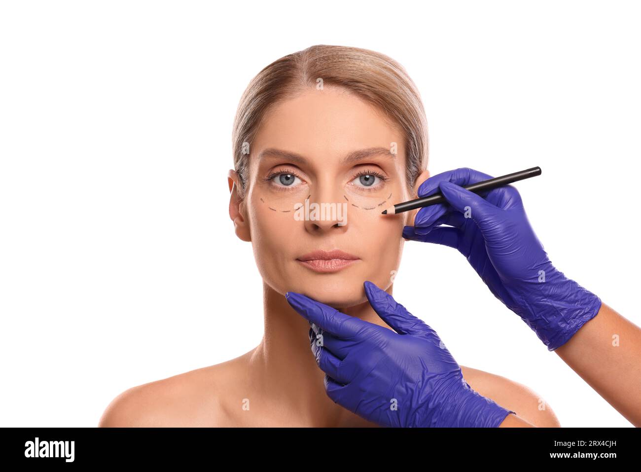 Doctor with pencil preparing patient for cosmetic surgery operation on ...