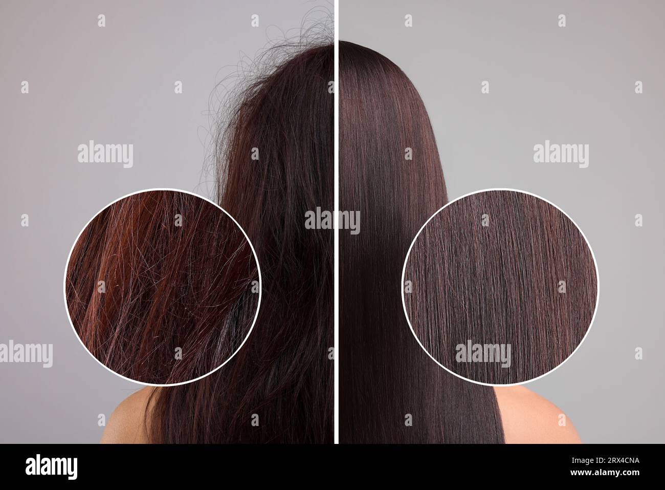 Photo of woman divided into halves before and after hair treatment on ...