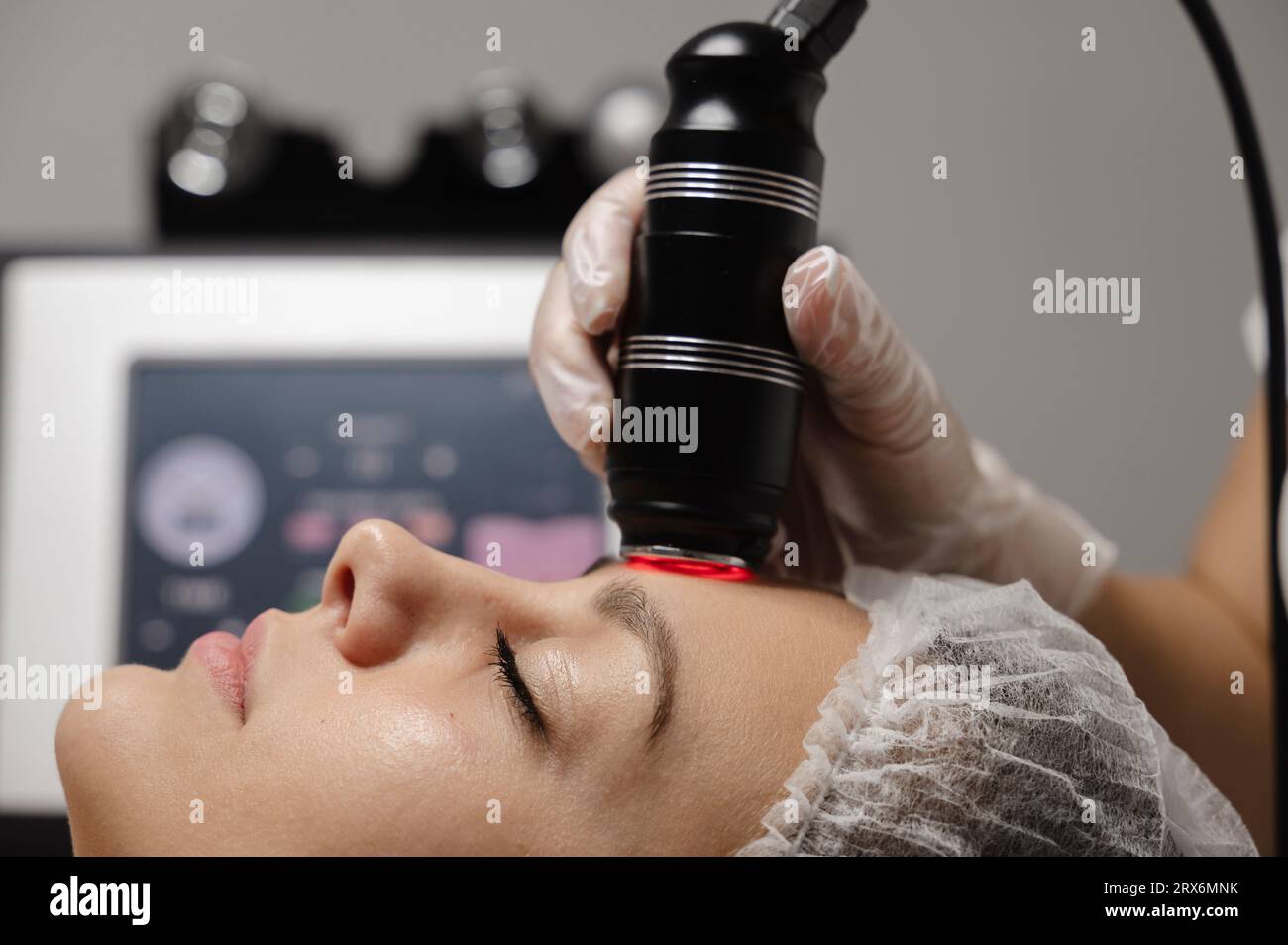 Dermatologist doing Rf lifting procedure on woman's face in clinic ...