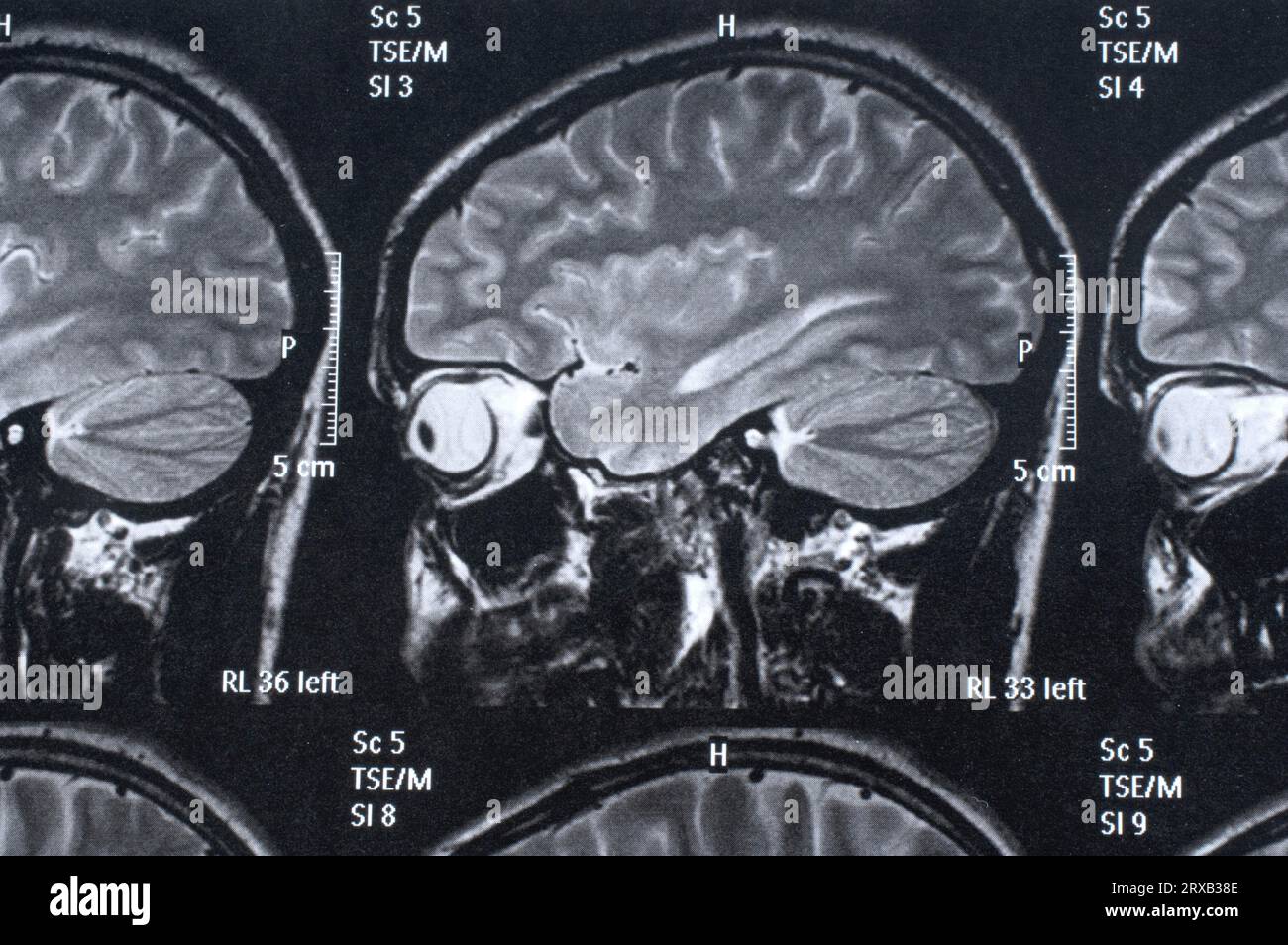 Magnetic resonance image of human head, x-ray, x-ray image, x-ray ...