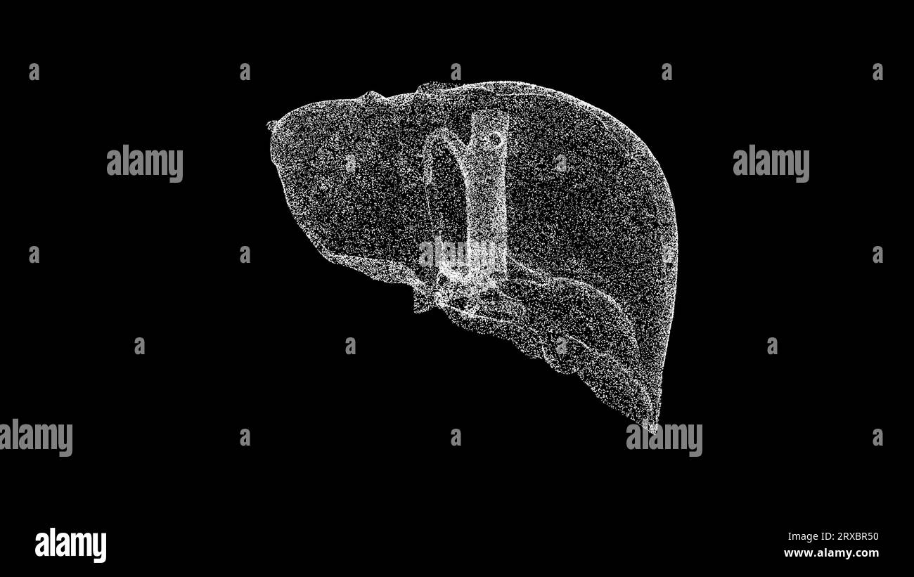 Hepatic surgery Black and White Stock Photos & Images - Alamy