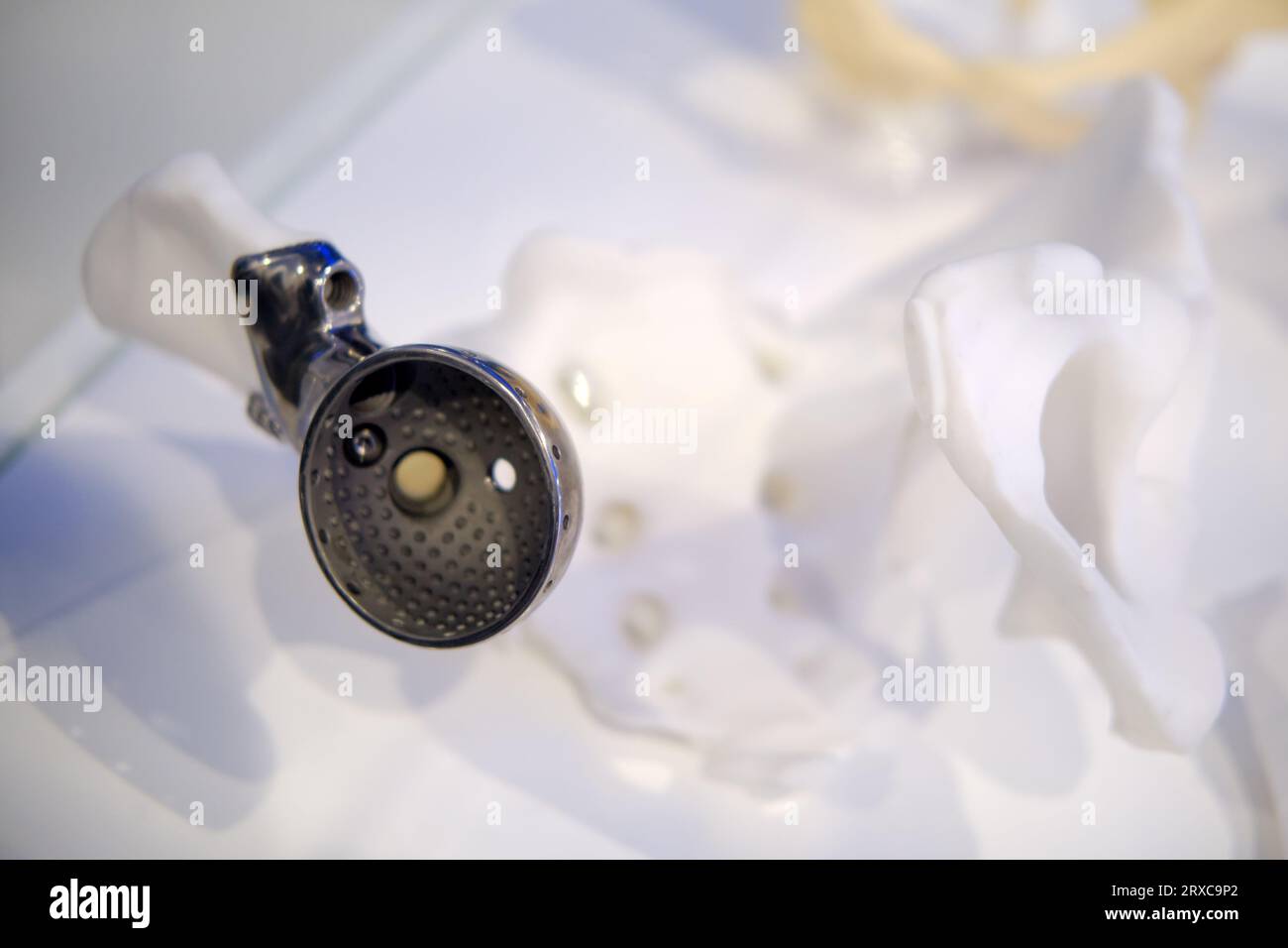 The artificial hip joint prosthesis allows individuals with hip ...