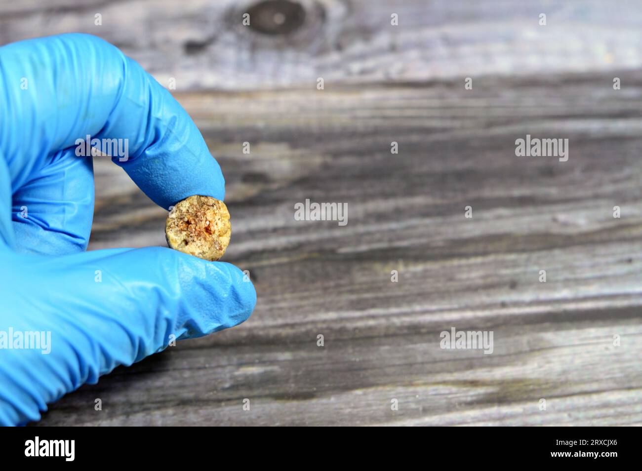 Laparoscopic gallbladder removal surgery hi-res stock photography and ...