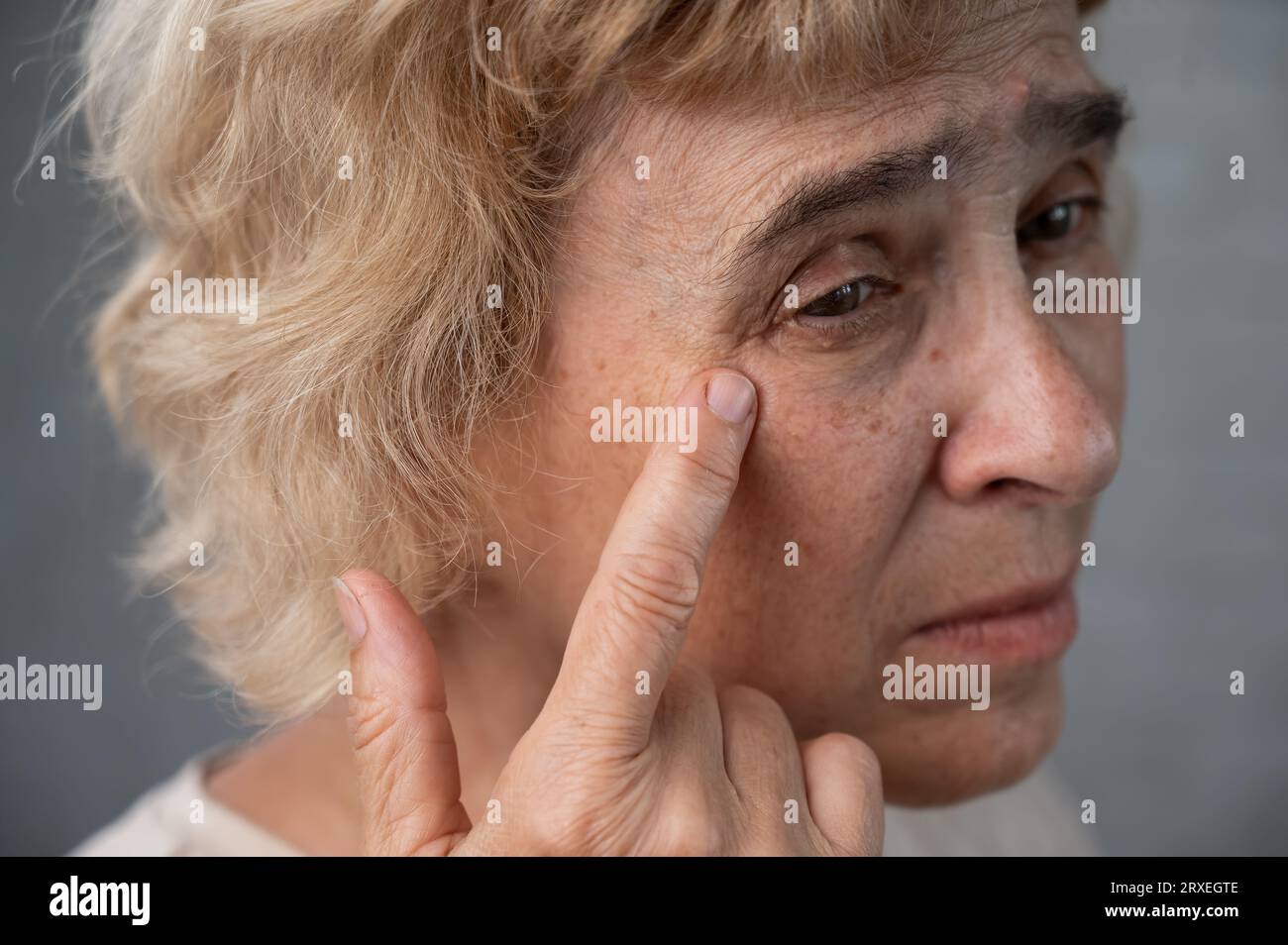 Close-up portrait of an old woman pointing at a wrinkle around her eyes ...