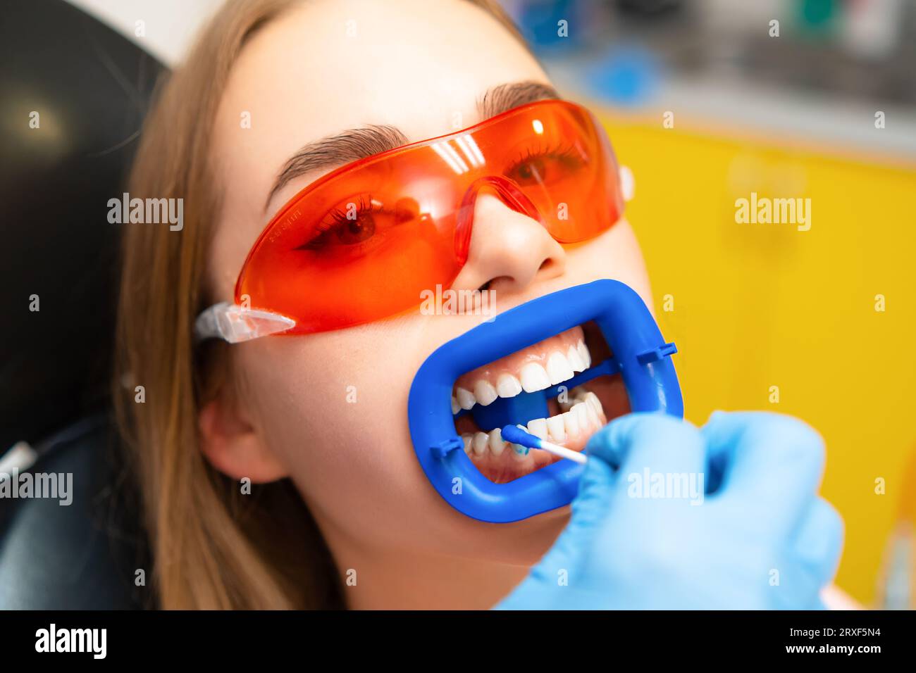 Dentist applies dental plaque gel detector to young woman patient in ...