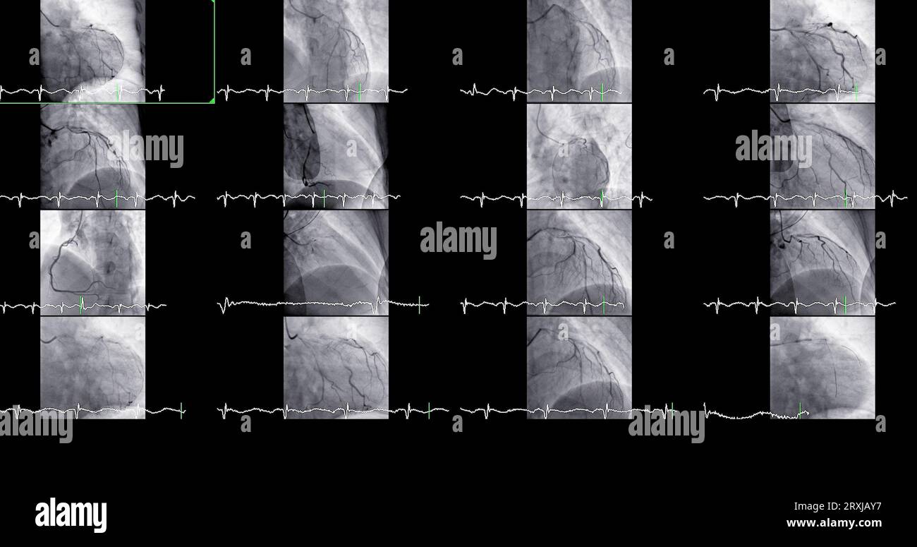Cardiac catheterization can help doctor diagnose and treat problems in your heart and blood ...