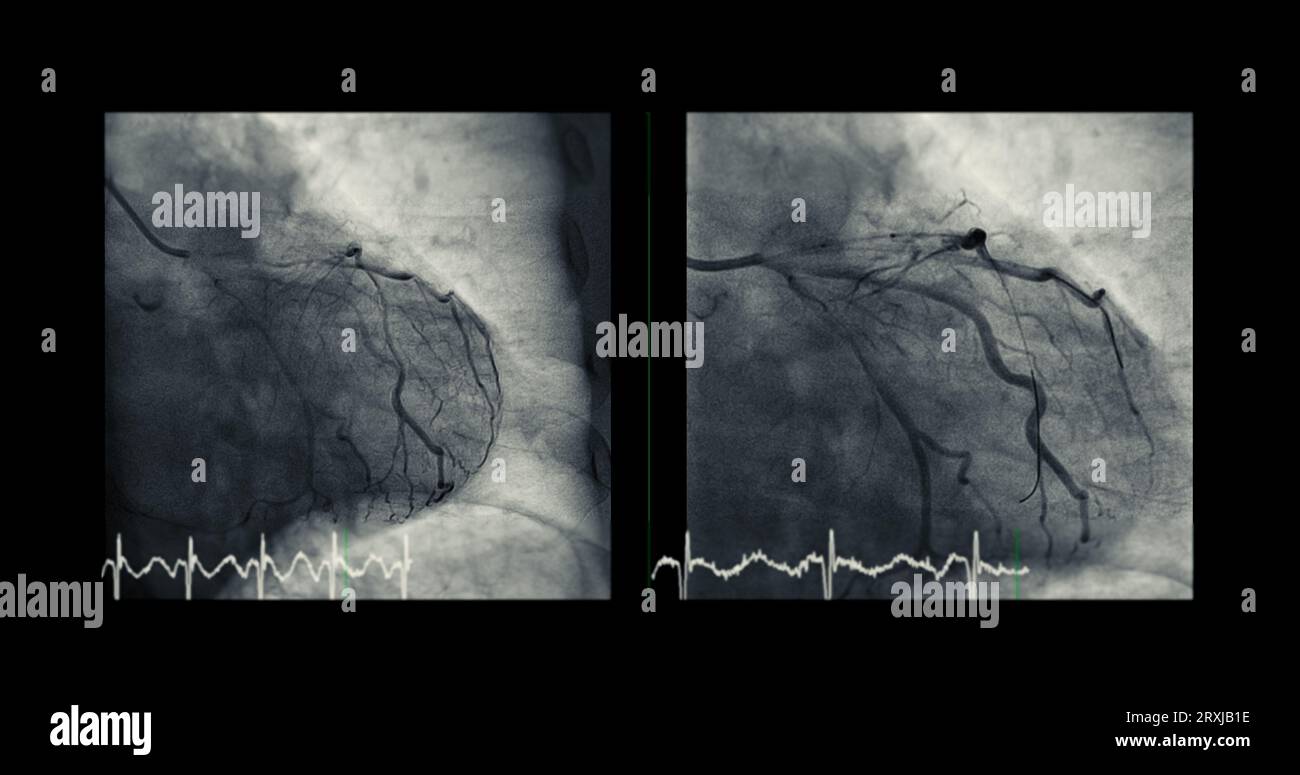 Cardiac catheterization can help doctor diagnose and treat problems in your heart and blood ...