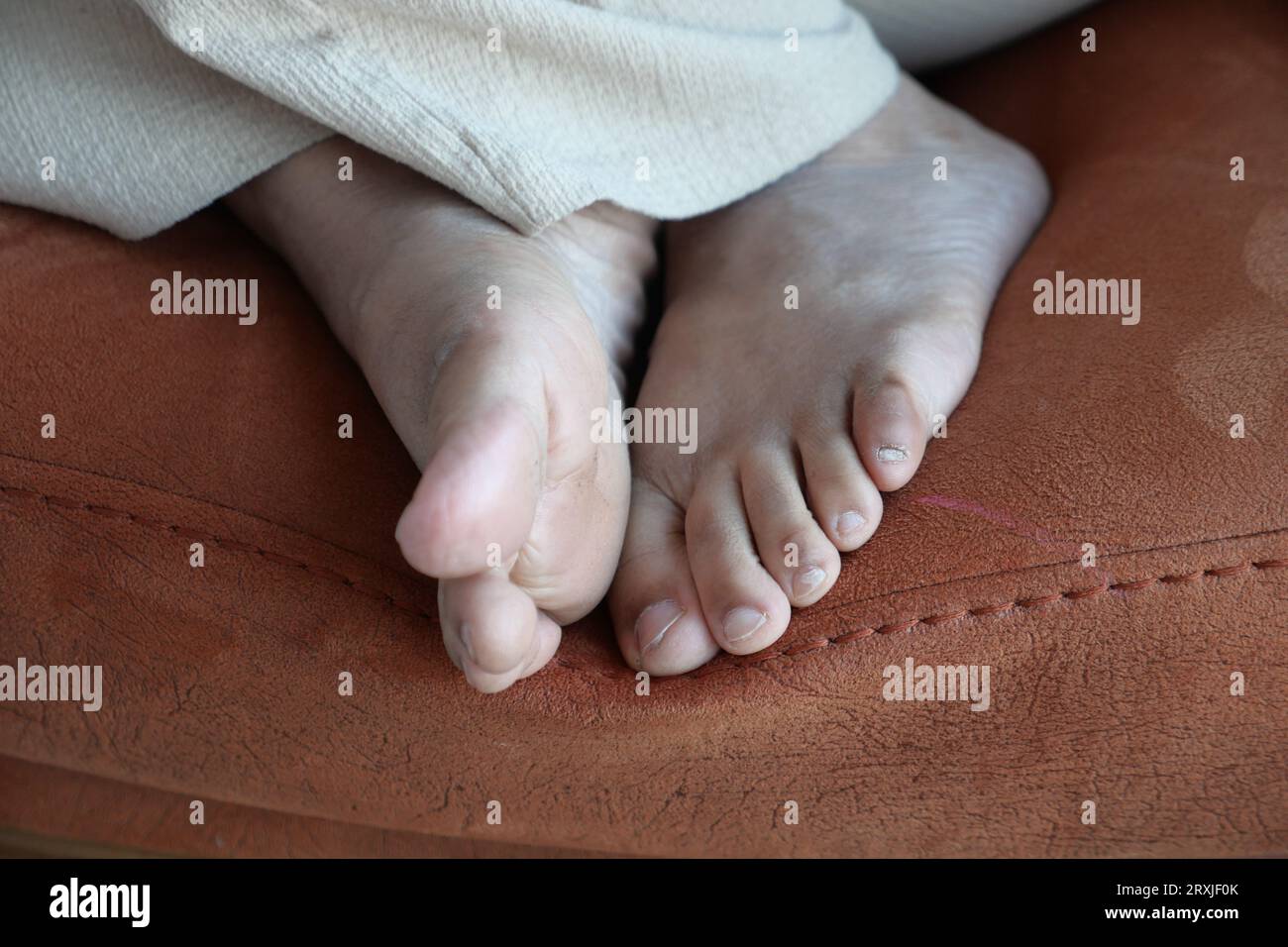close up of women feet with swelling Stock Photo - Alamy