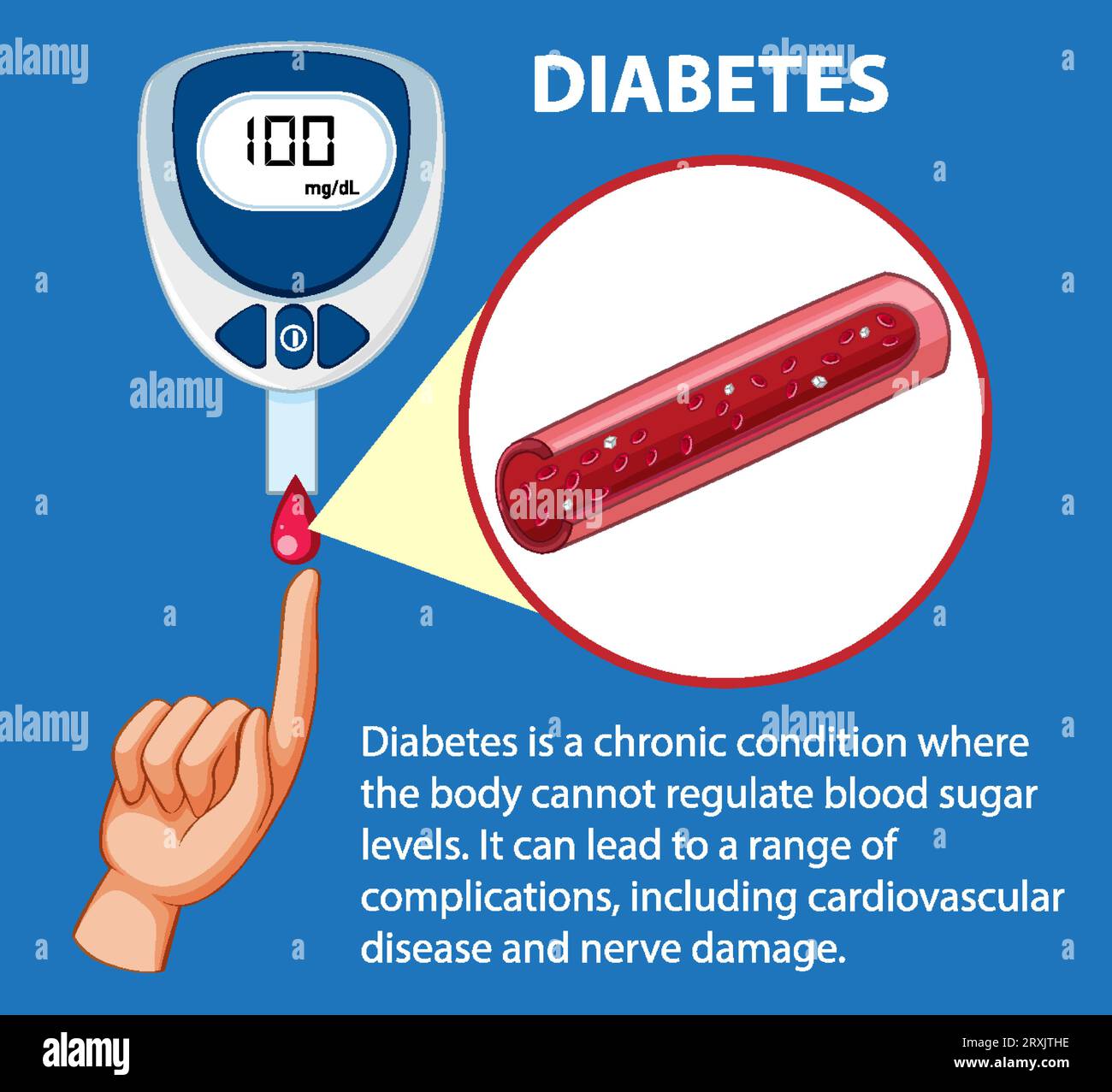 Vector cartoon illustration of a glucose meter device checking diabetes ...