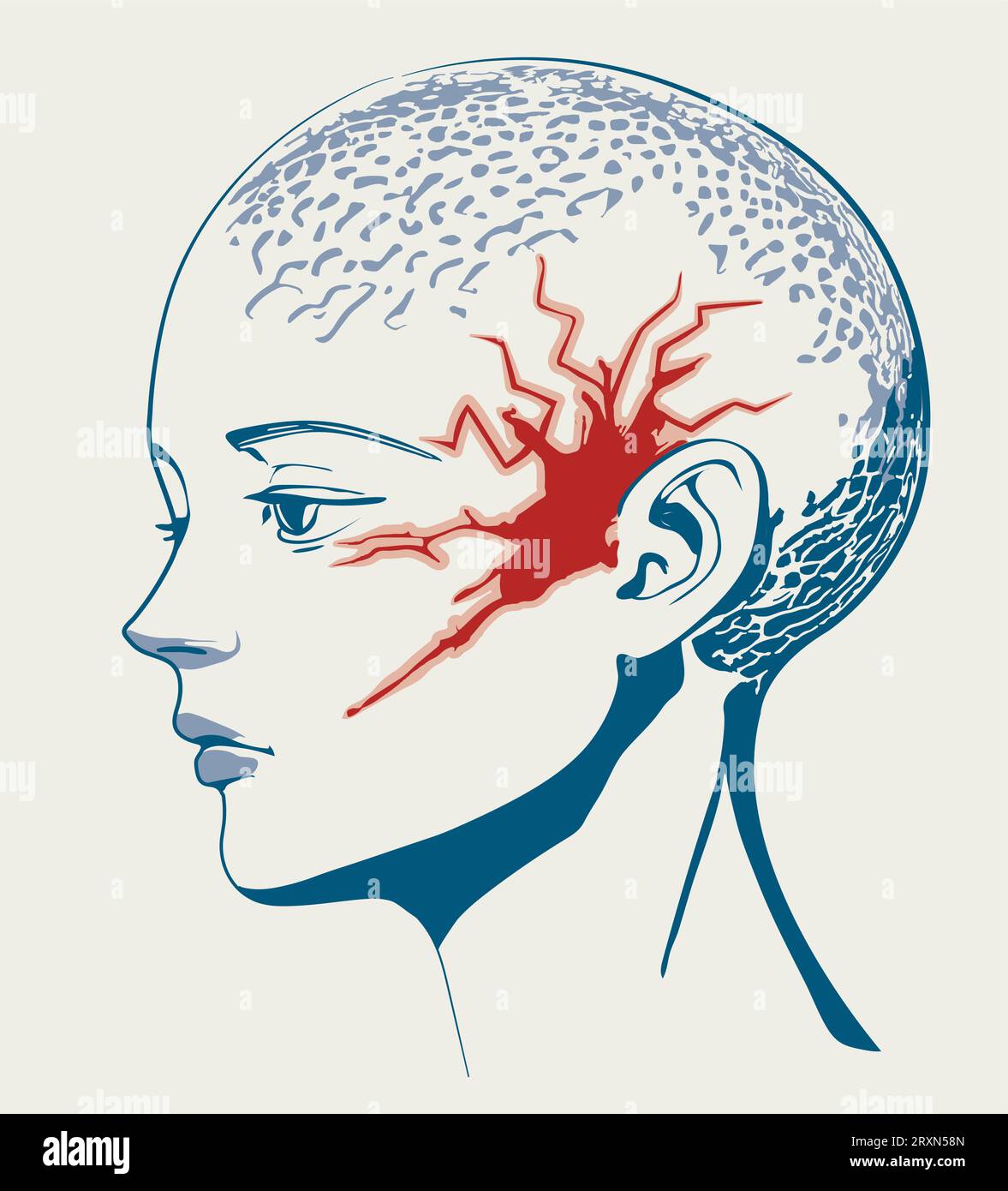 Pain in the head, brain and synapses, cognitive problems, mental ...