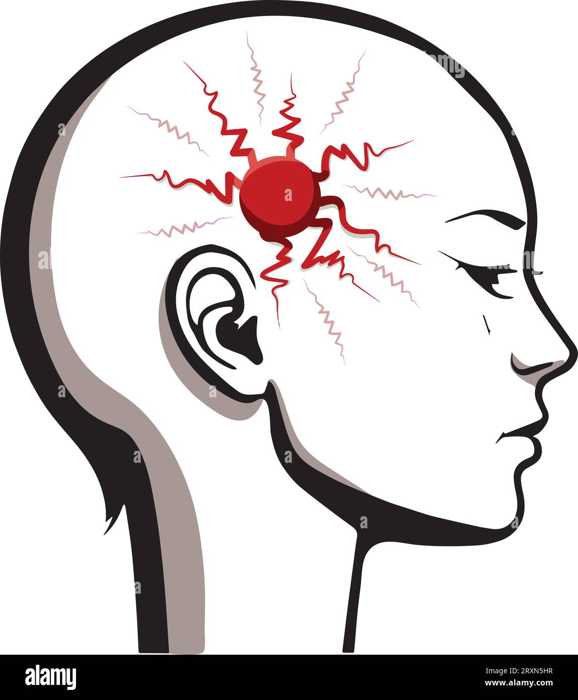 Pain in the head, brain and synapses, cognitive problems, mental ...