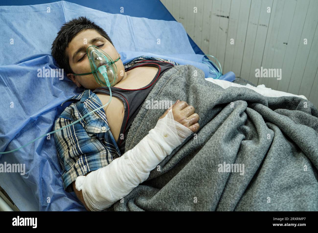 Hamdaniya, Iraq. 27th Sep, 2023. An Iraqi boy with burns in his hands ...