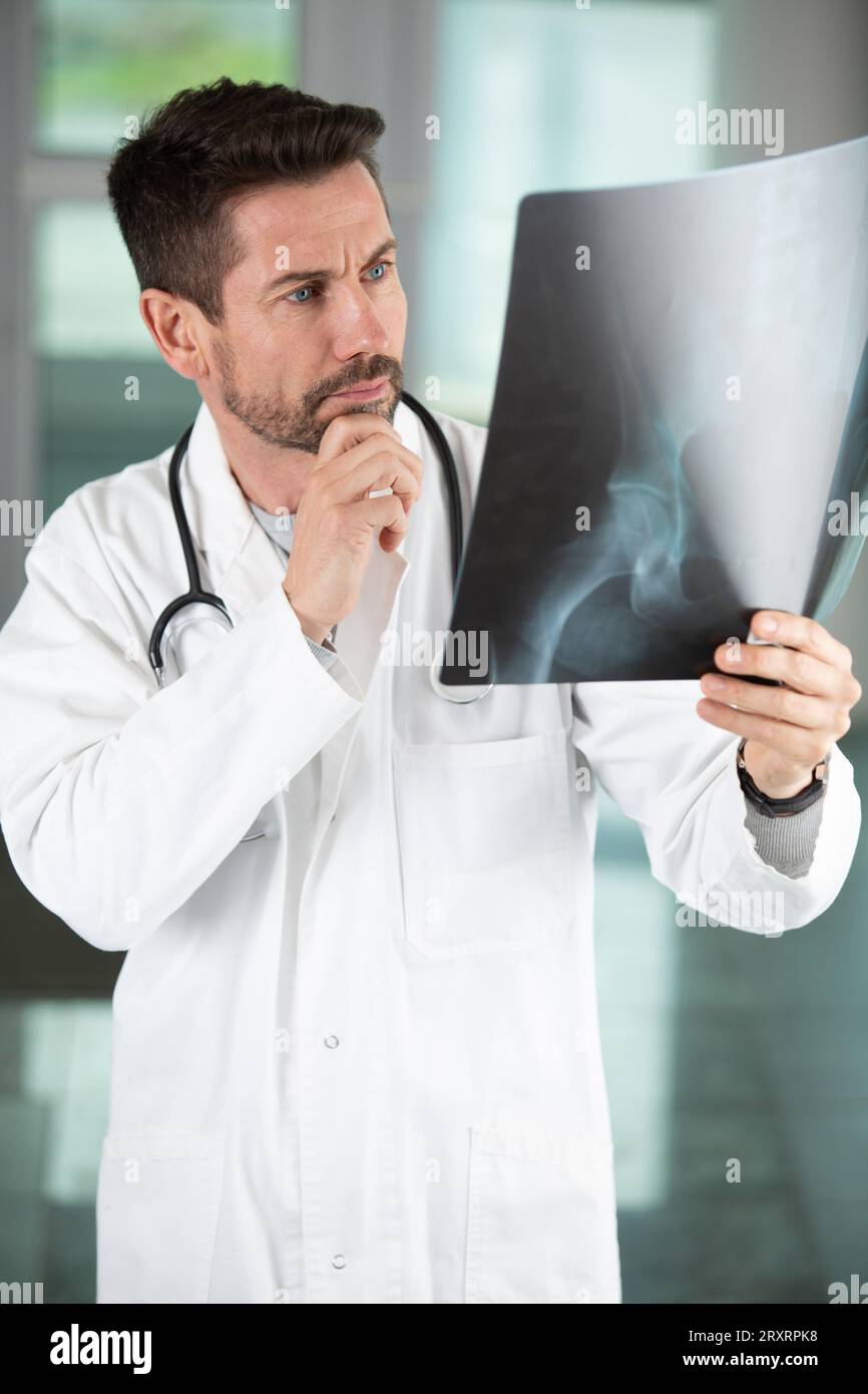 Pulmonary radiography hi-res stock photography and images - Alamy