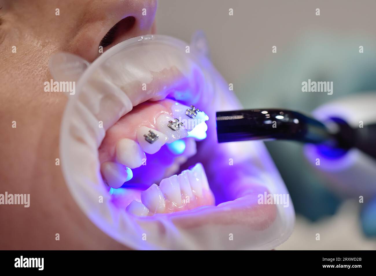 Dentist lamp with teeth hi-res stock photography and images - Alamy