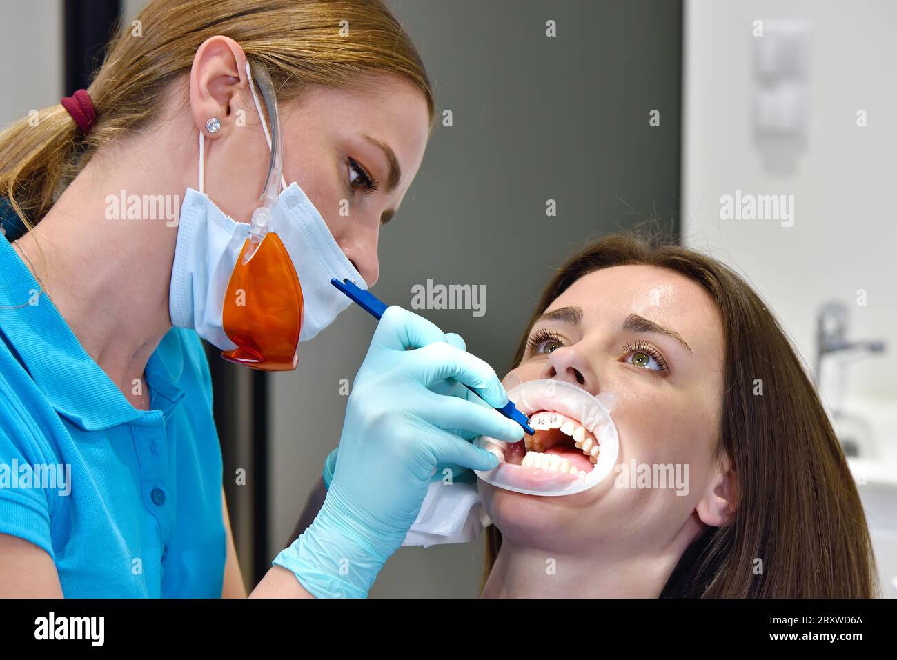 Procedure For Fixing Braces On The Teeth. Healthcare And Medical ...