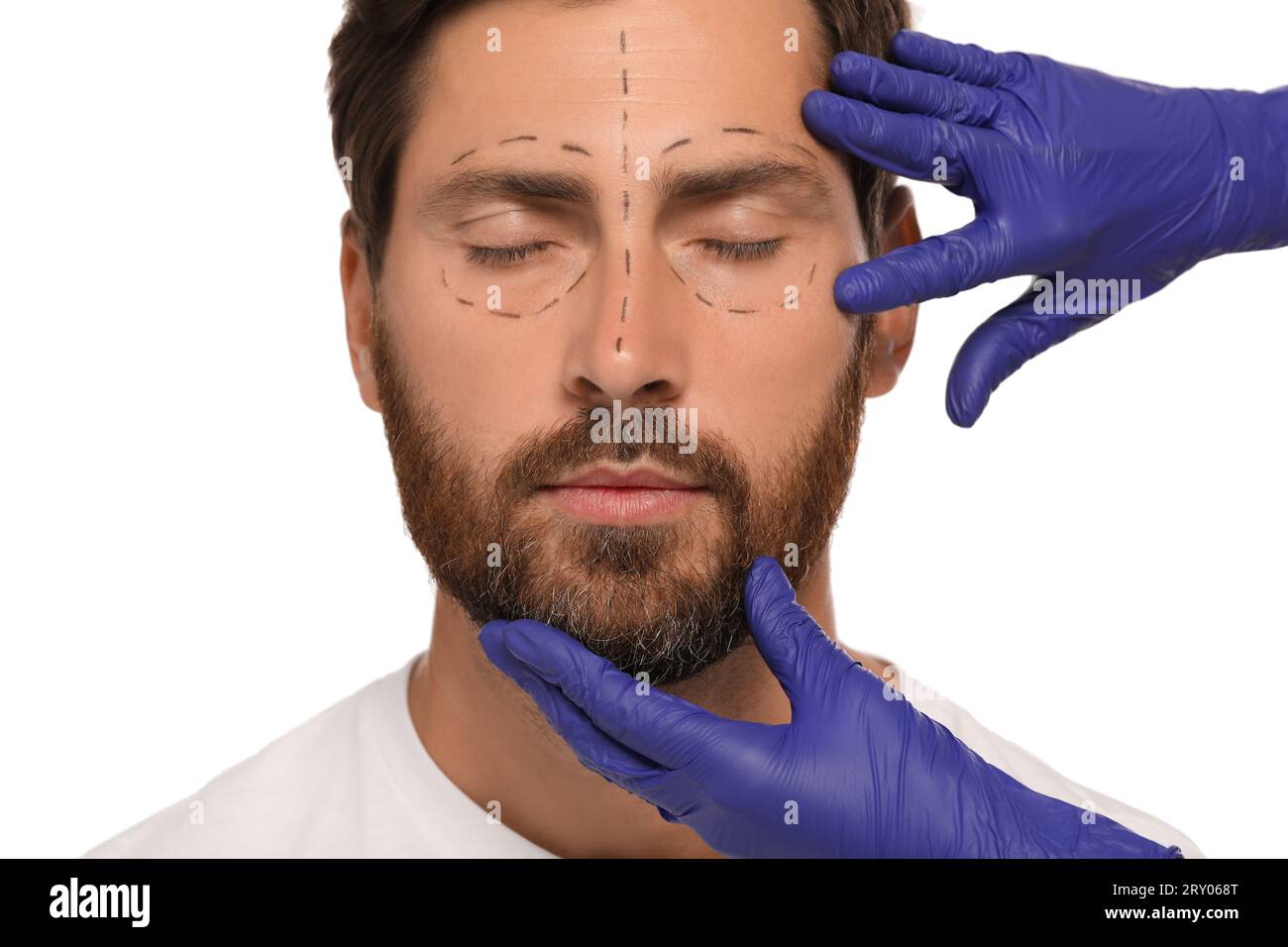 Doctor checking patient's face before cosmetic surgery operation on ...
