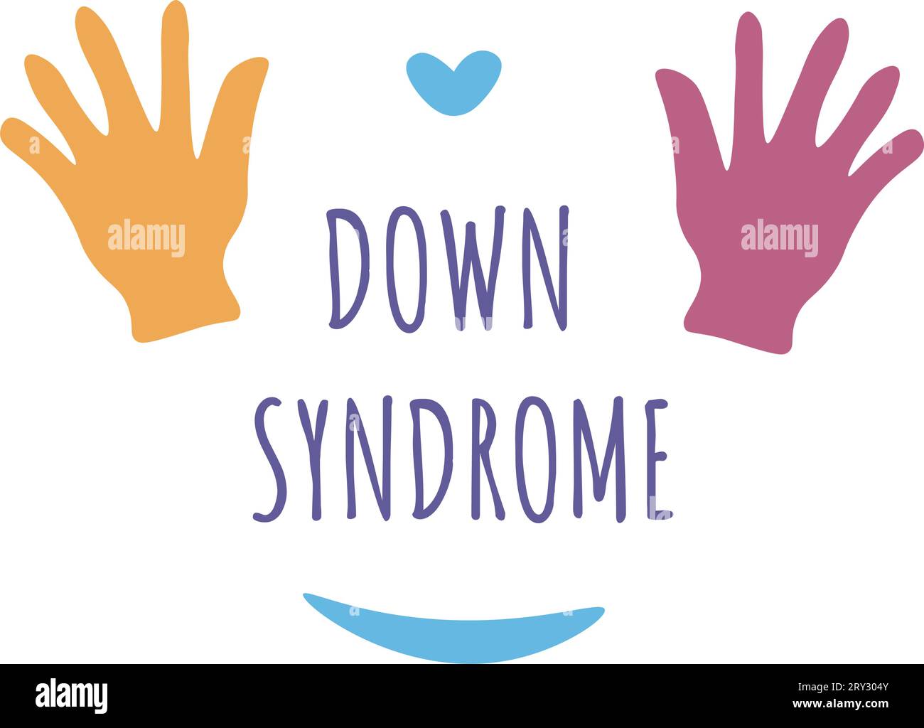Down syndrome, trisomy genetic disorder vector Stock Vector Image & Art ...