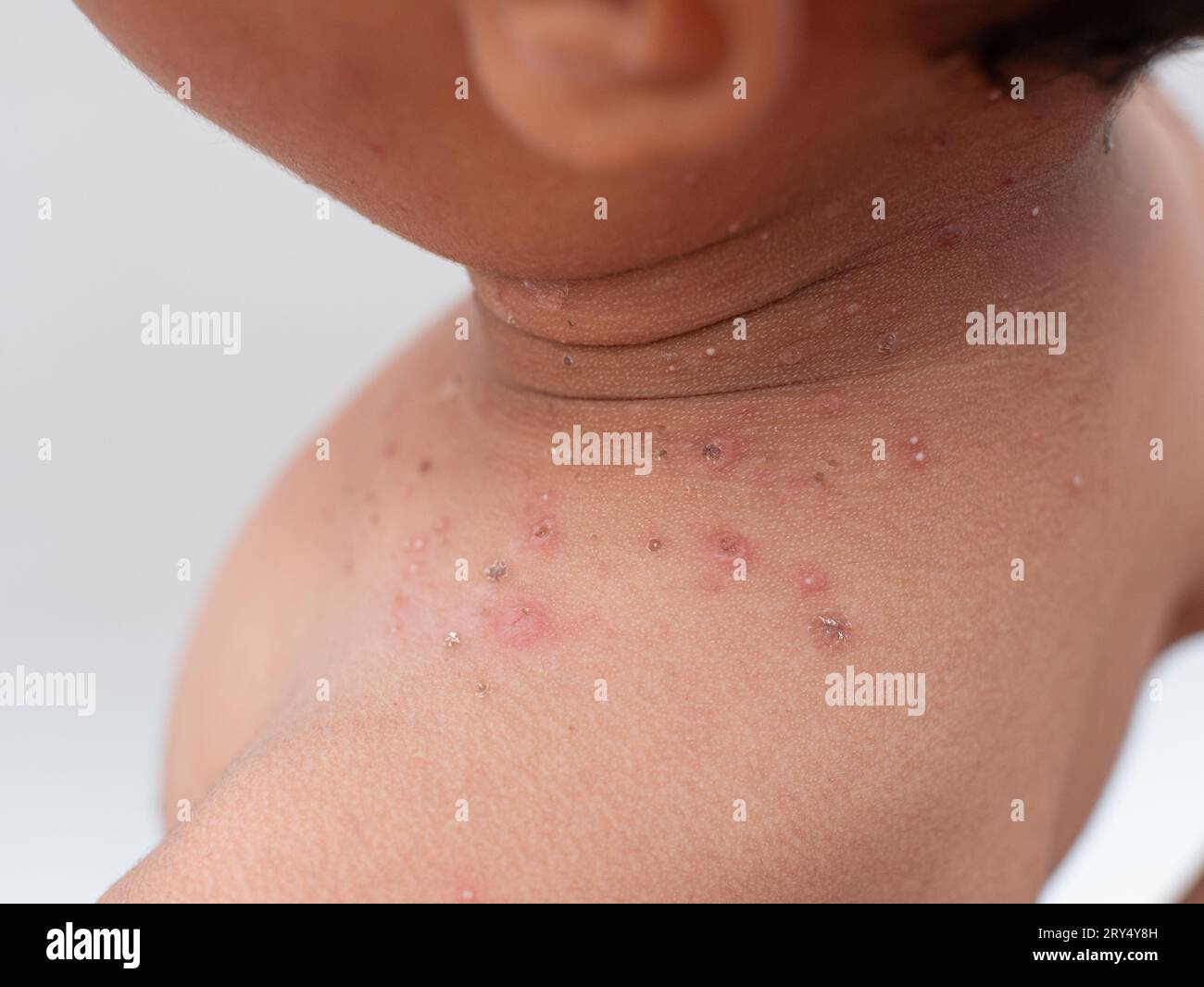 Shoulder scratch hi-res stock photography and images - Alamy