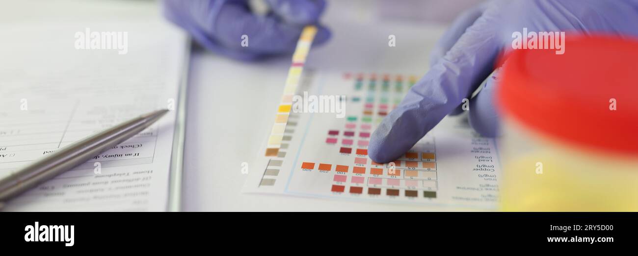 Worker checks results of urine test looking at color palette Stock ...