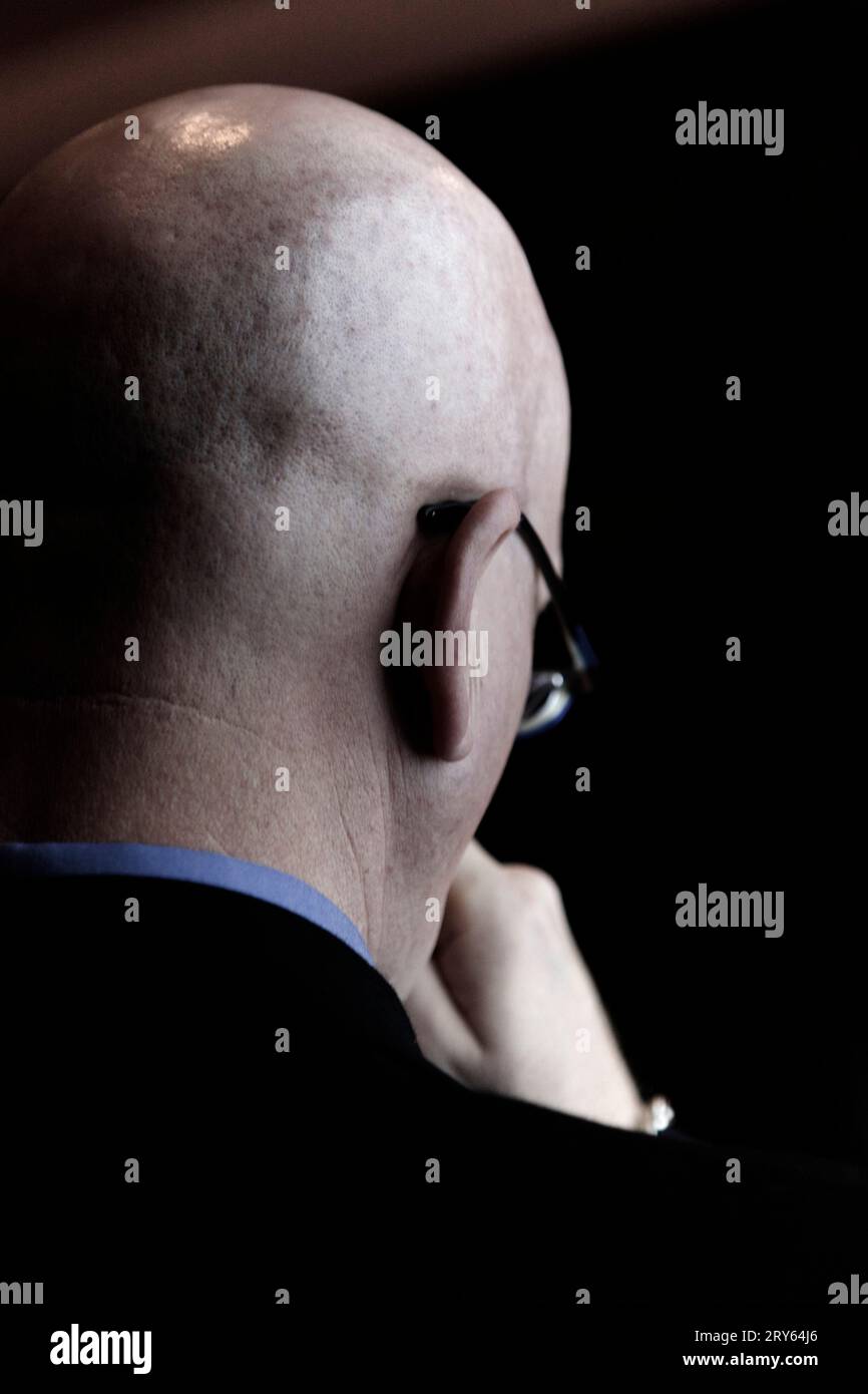 The back of bald man's head Stock Photo - Alamy