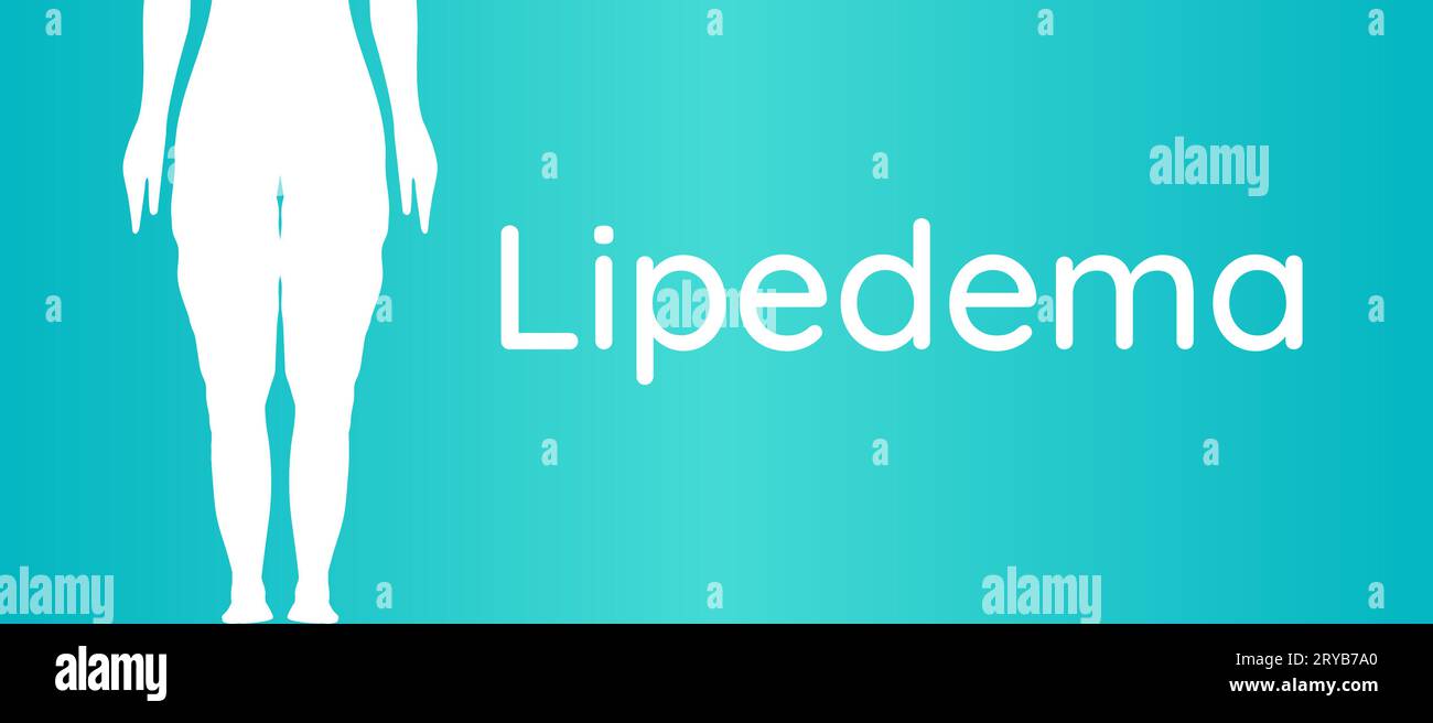 Lipedema Medical Background Illustration Banner Stock Vector Image And Art Alamy