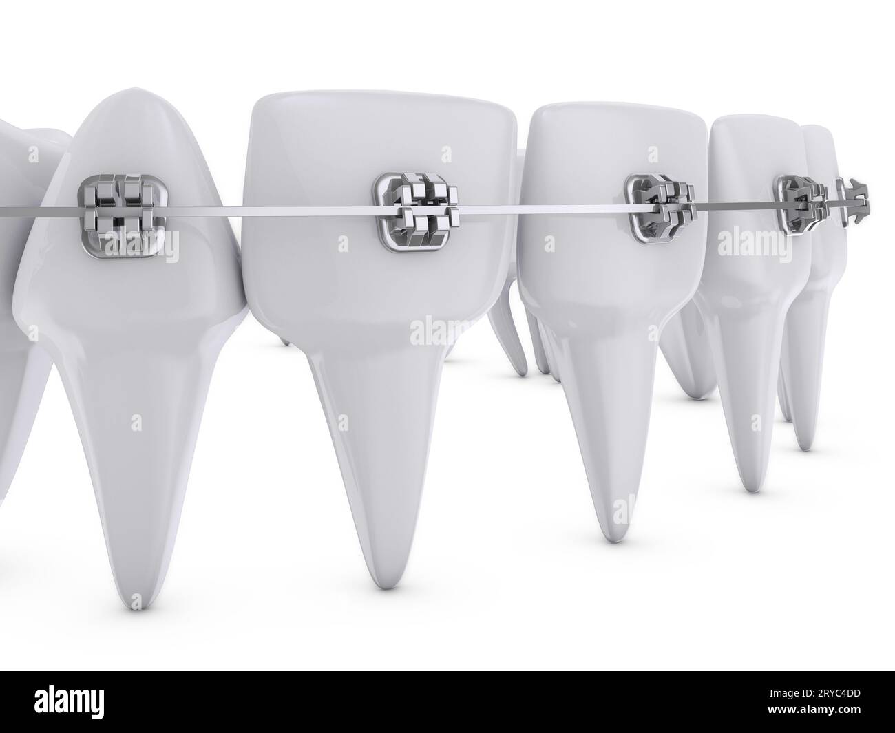 Brackets dental hi-res stock photography and images - Alamy