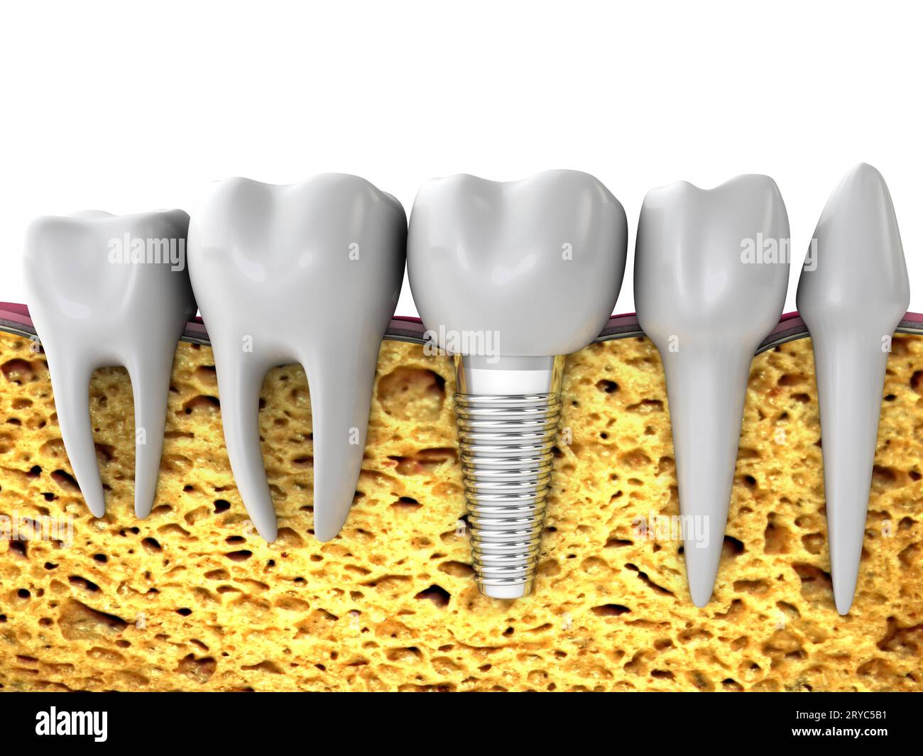 Human jaw bone hi-res stock photography and images - Alamy