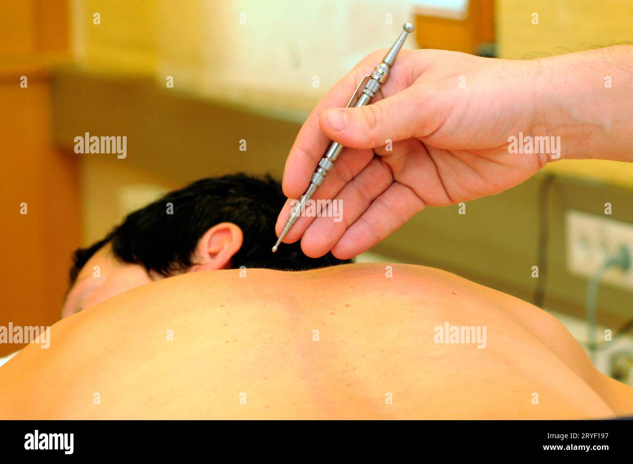 Acupuncture used during a massage Stock Photo - Alamy
