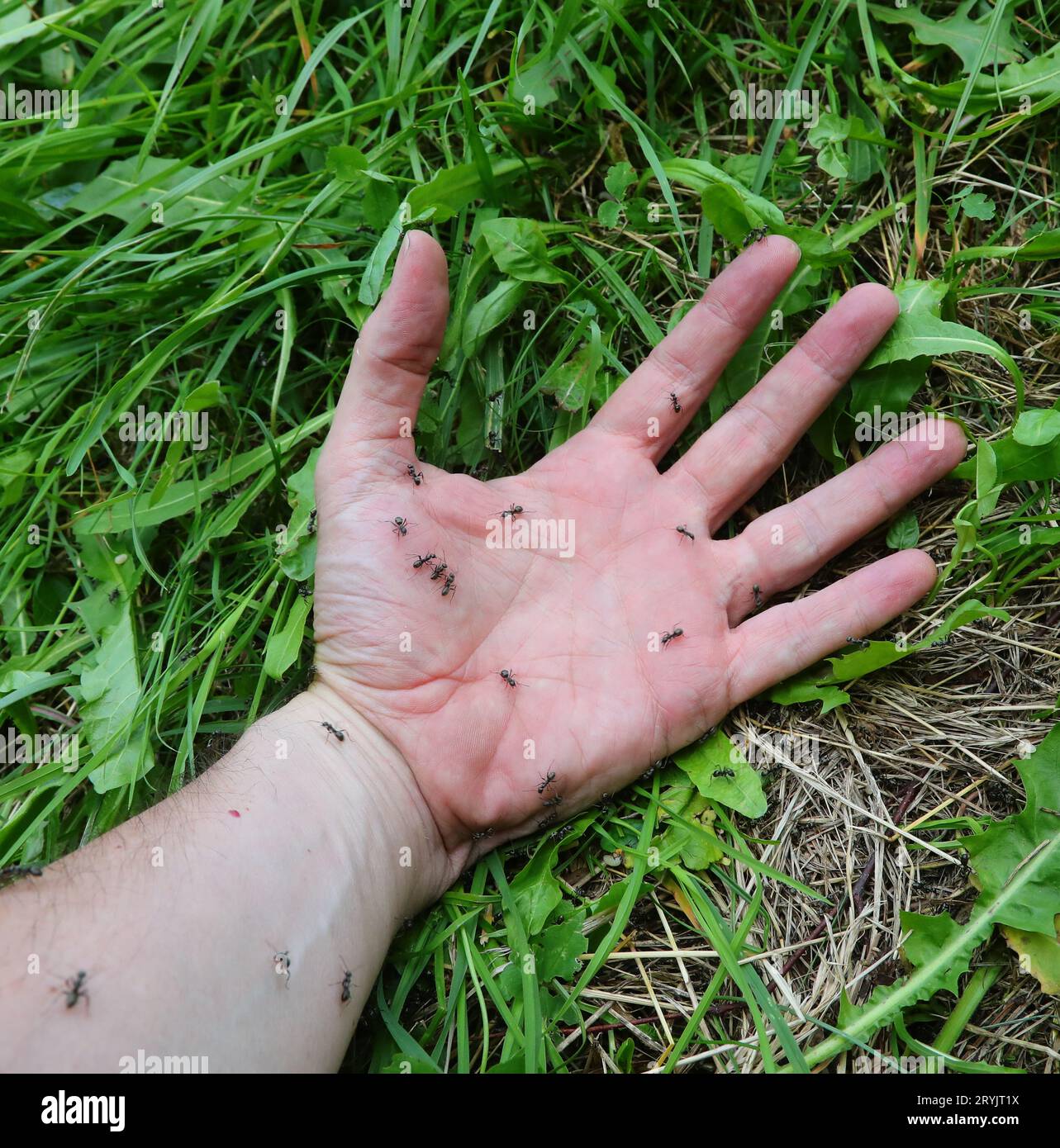 hand of person with black ants above that bite and sting and cause ...