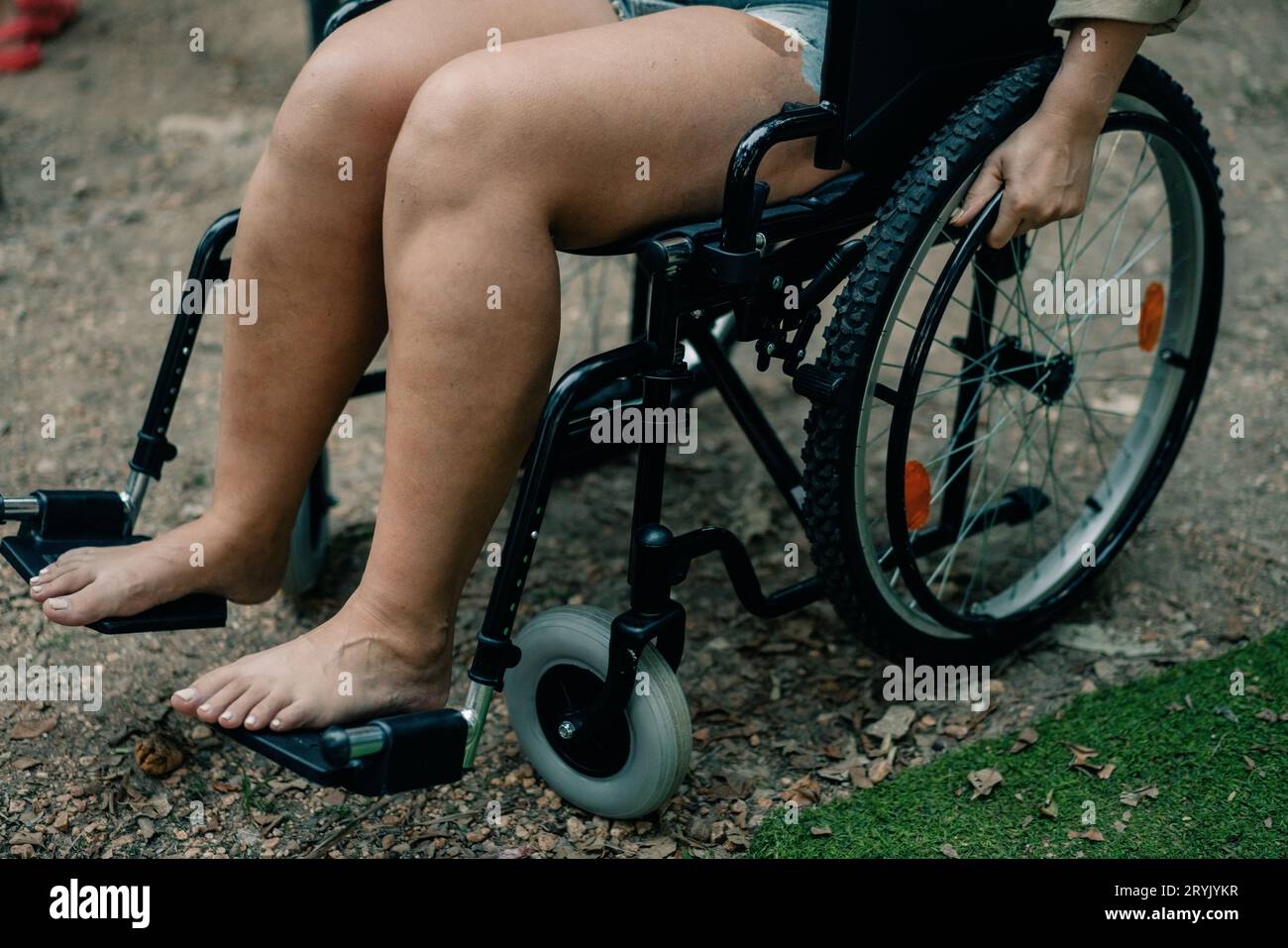 Obese patient and wheelchair hi-res stock photography and images - Alamy