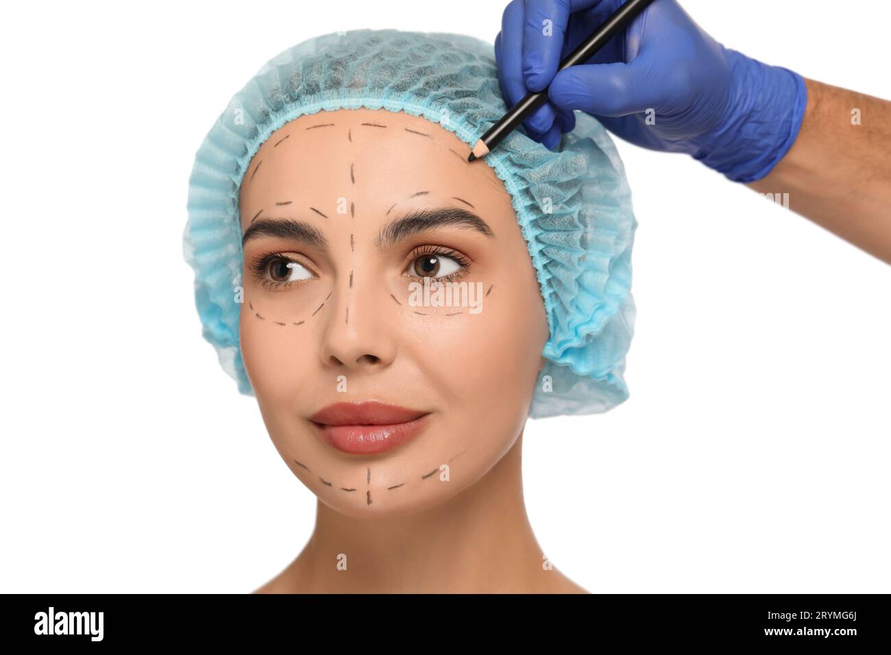 Doctor with pencil preparing patient for cosmetic surgery operation on ...